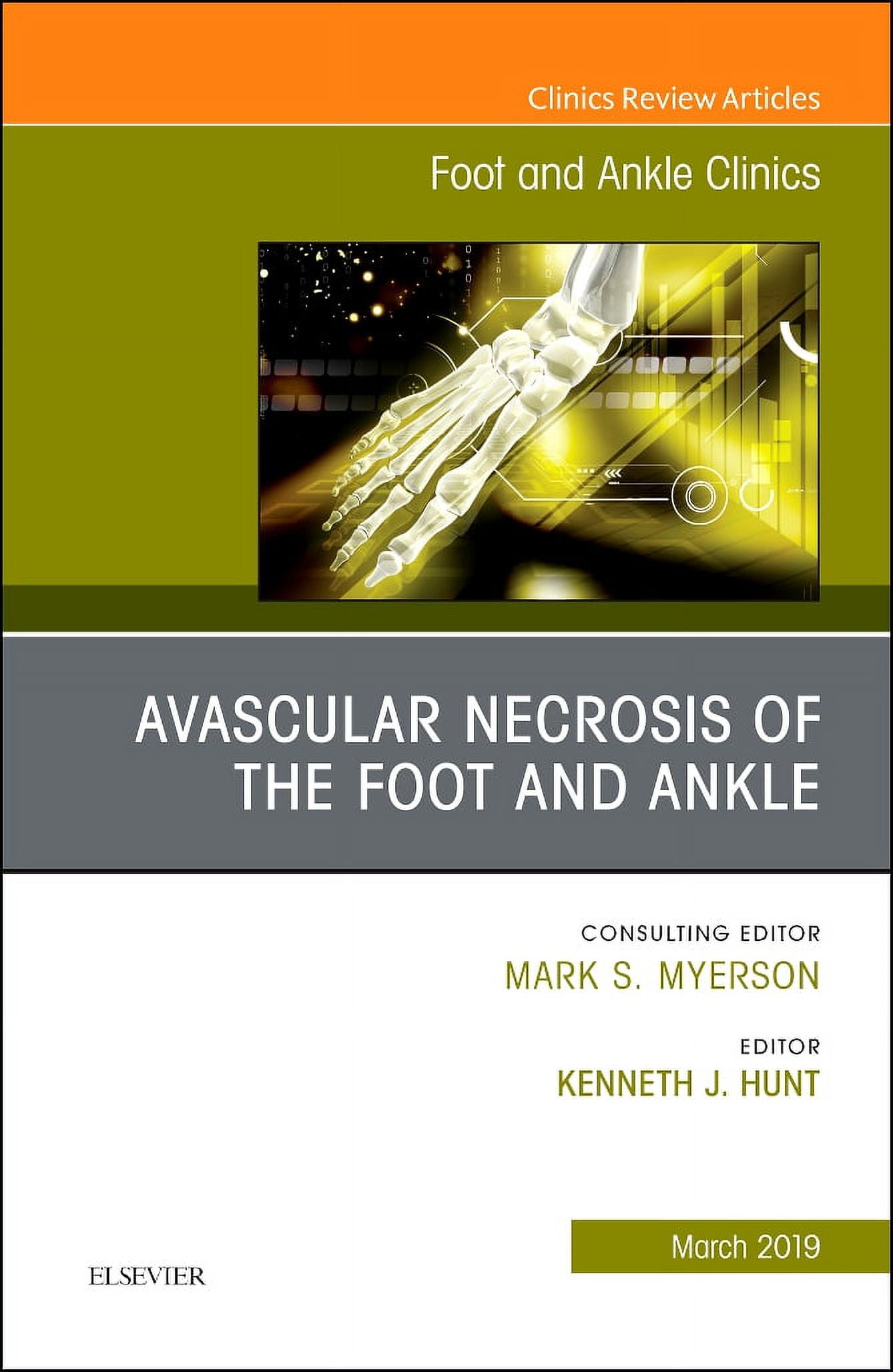 Avascular necrosis of the foot and ankle, An issue of Foot and Ankle ...