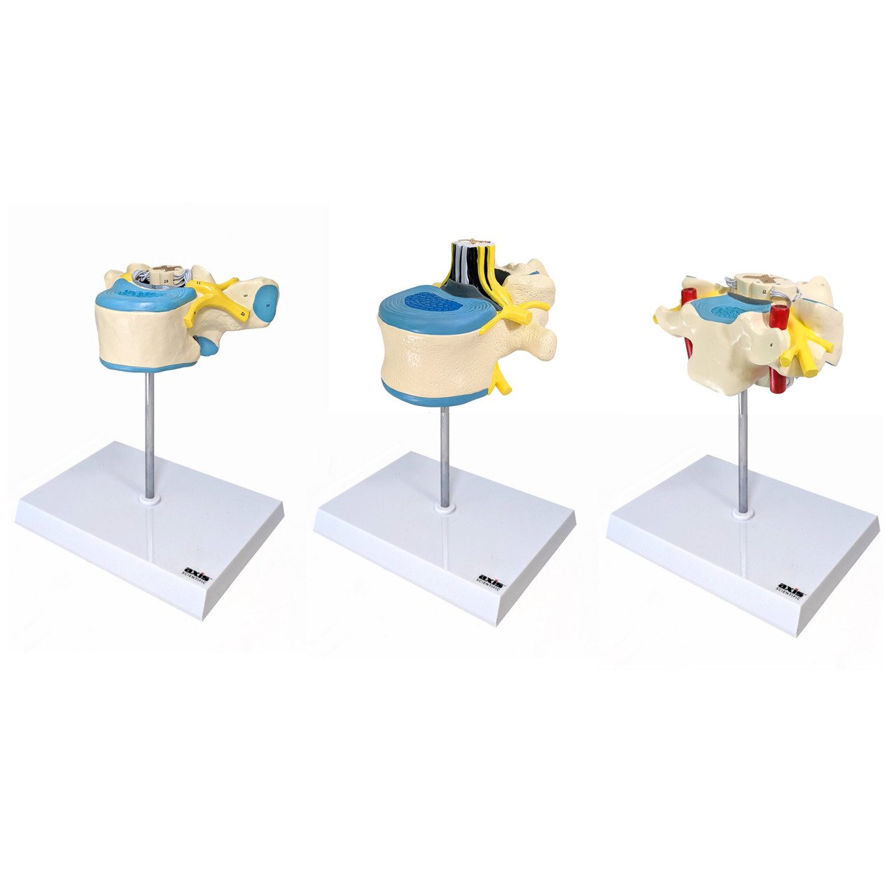 Axis Scientific Enlarged Vertebra with Spinal Cord and Nerves, 3-Piece ...