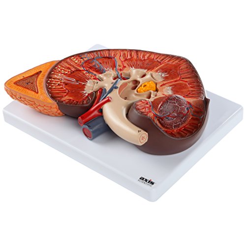 Axis Scientific Human Kidney Model | Anatomical Model is Enlarged to 3 ...