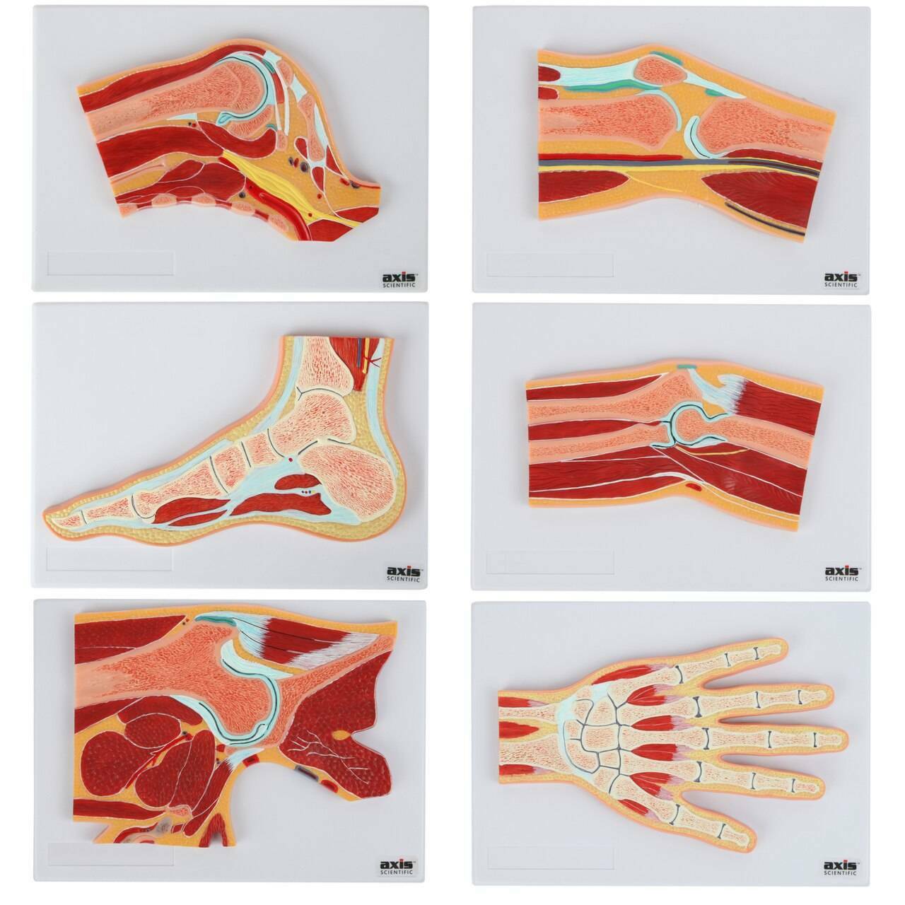 Axis Scientific Joint Cross Section Model Set, Includes Knee Elbow ...