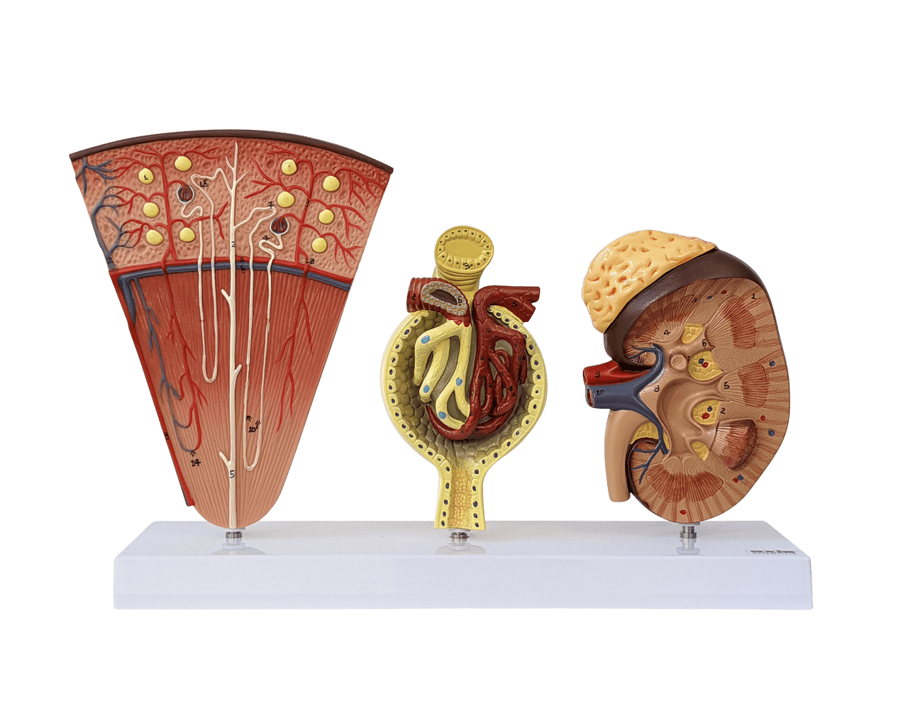 Axis Scientific Kidney Model with Nephrons and Glomerulus - Enlarged ...