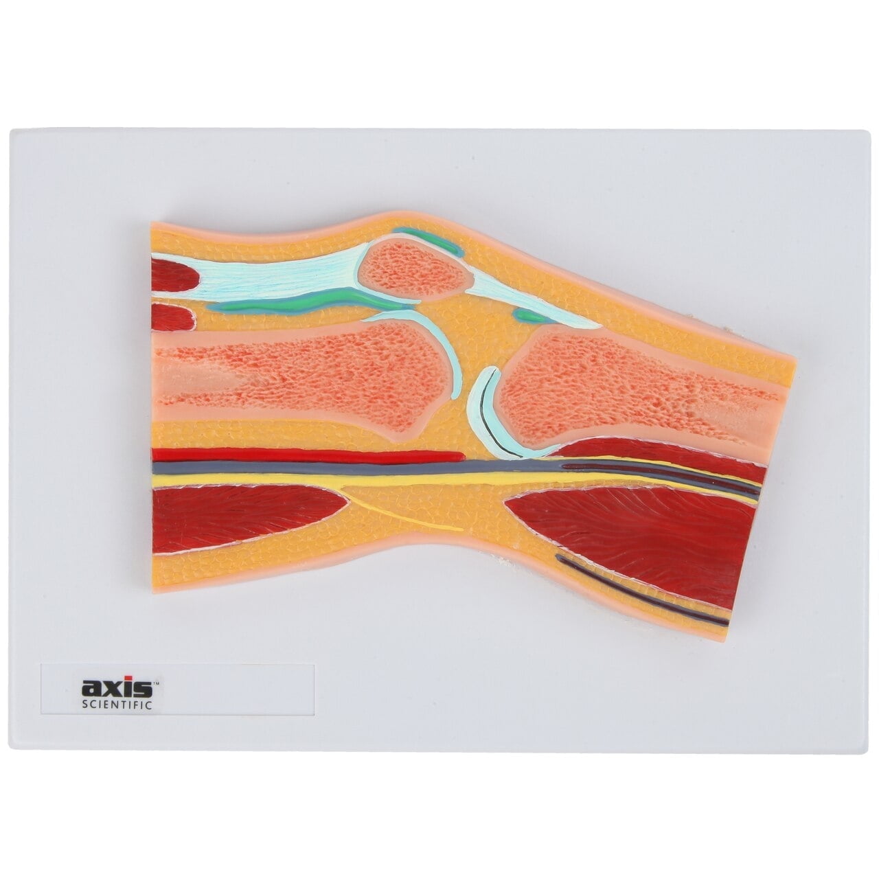 Axis Scientific Life Size Knee Joint Cross Section Anatomy Model Human ...