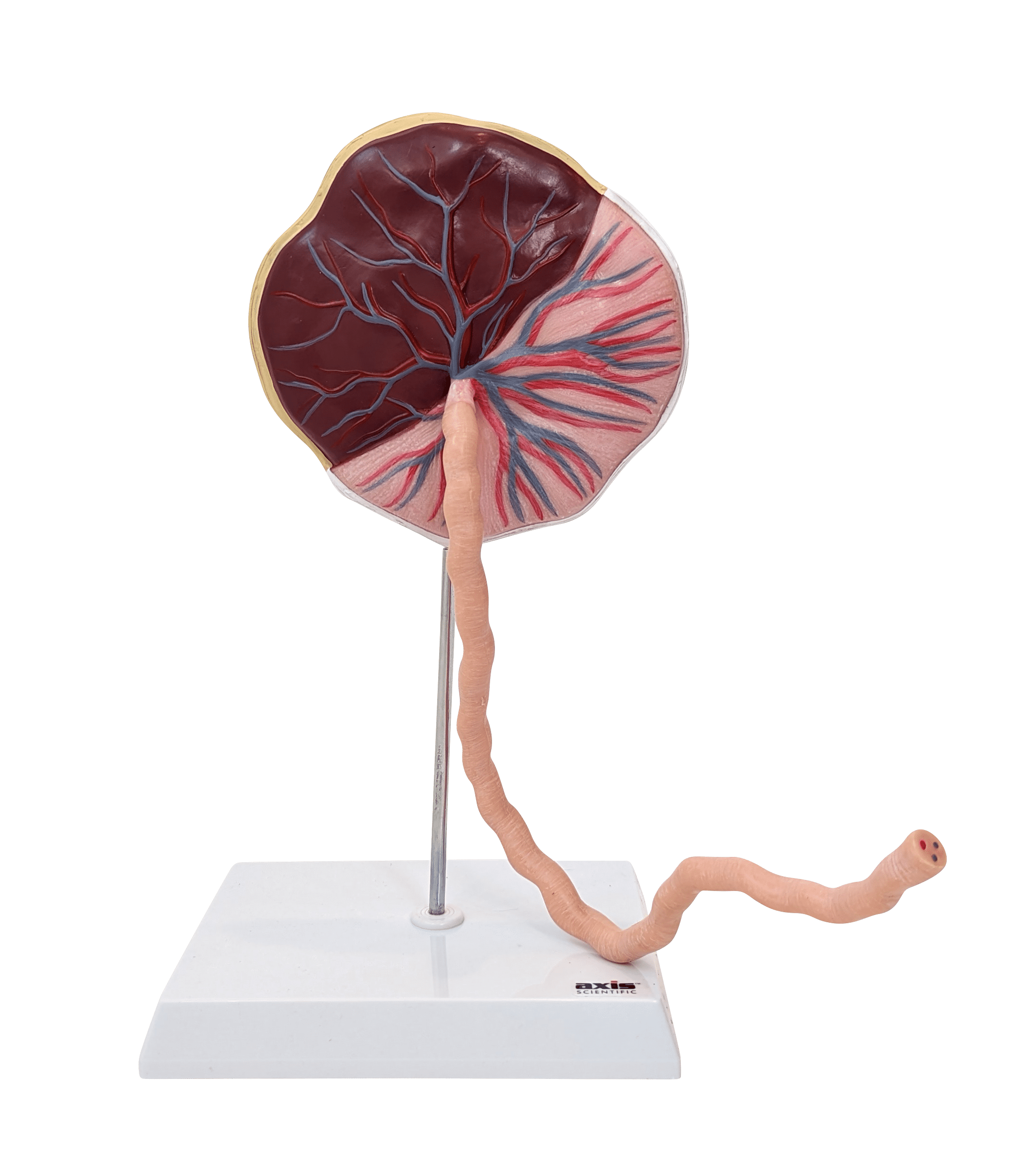 Axis Scientific Placenta Model with Removable Umbilical Cord - Walmart.com