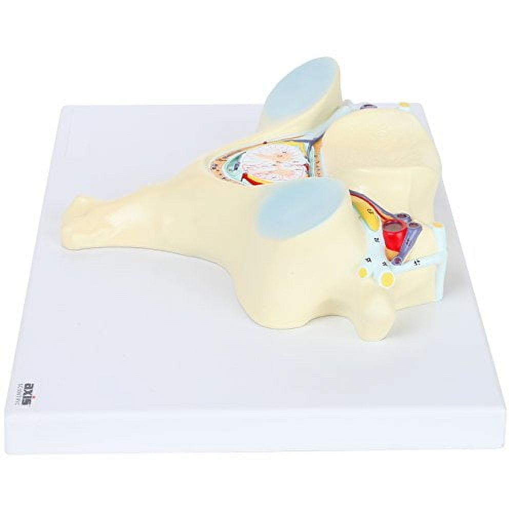 Axis Scientific Spine Model of Enlarged 5th Cervical Vertebra | Anatomy ...