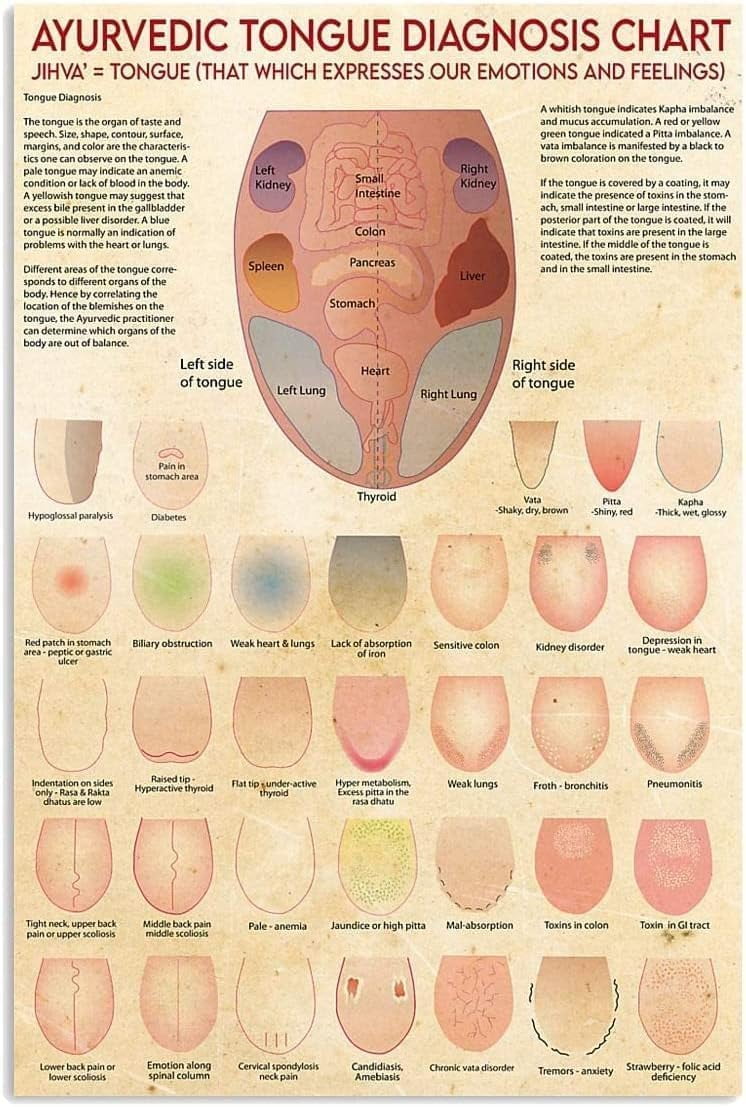 Ayurveda Tongue Diagnosis Chart Metal Tin Sign Medical Knowledge Poster ...