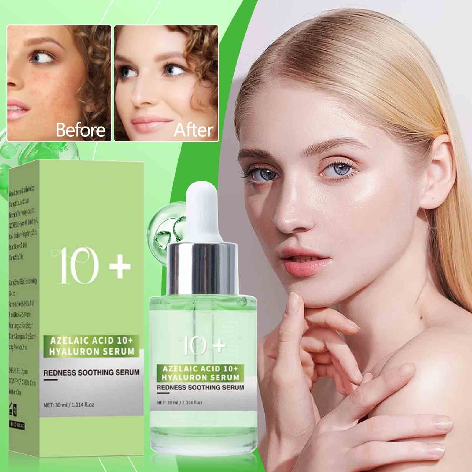 Azelaic 10 Hyaluron Serum Facial Serum For Sensitive Skin Organic ...