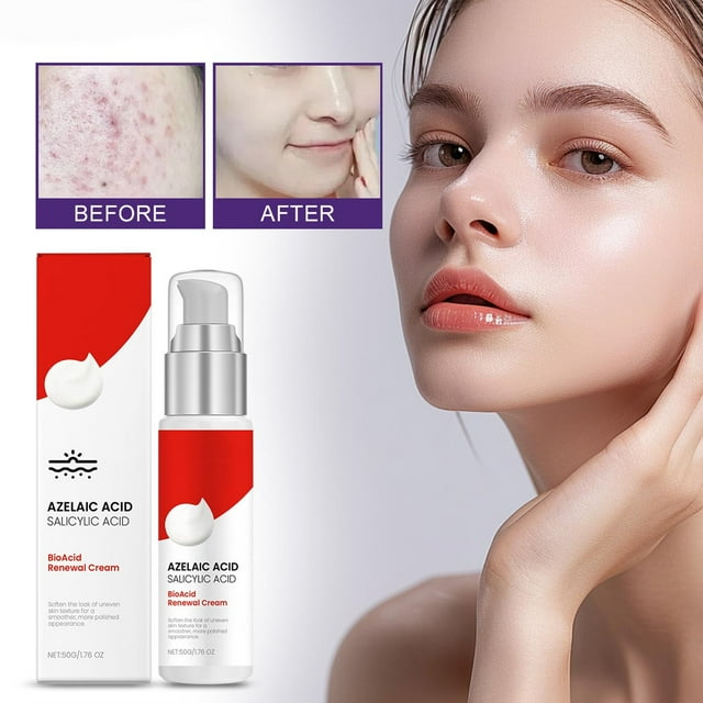 Azelaic Acid Serum, Brightening Spot Treatment for Even Skin Tone, Oil Control & Pore Minimizing ...