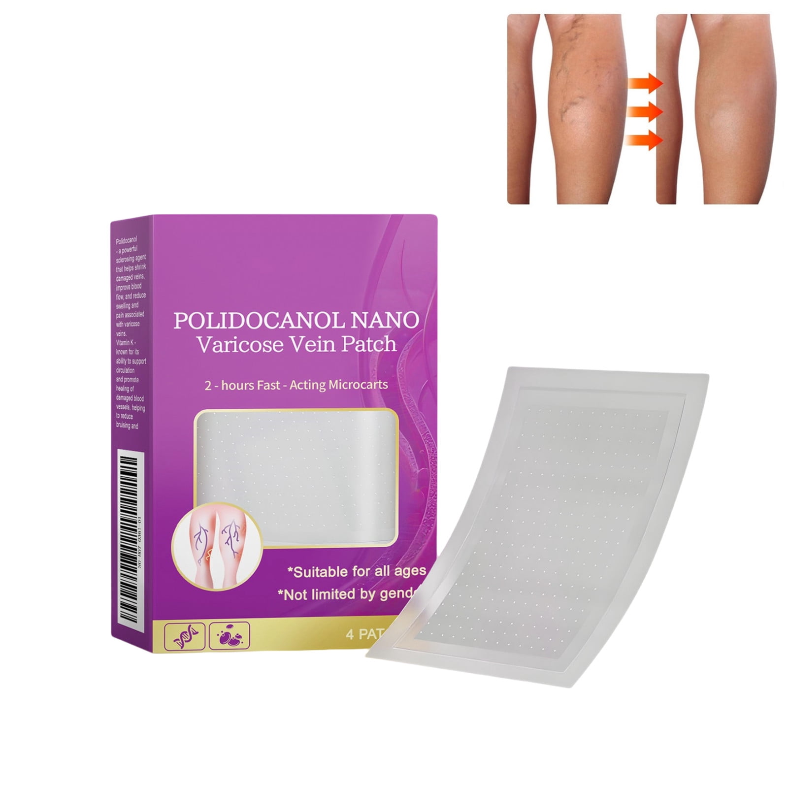 BCGPSHOP Nano Varicose Veins Plaster,Eliminate Varicose Veins,Naturally ...