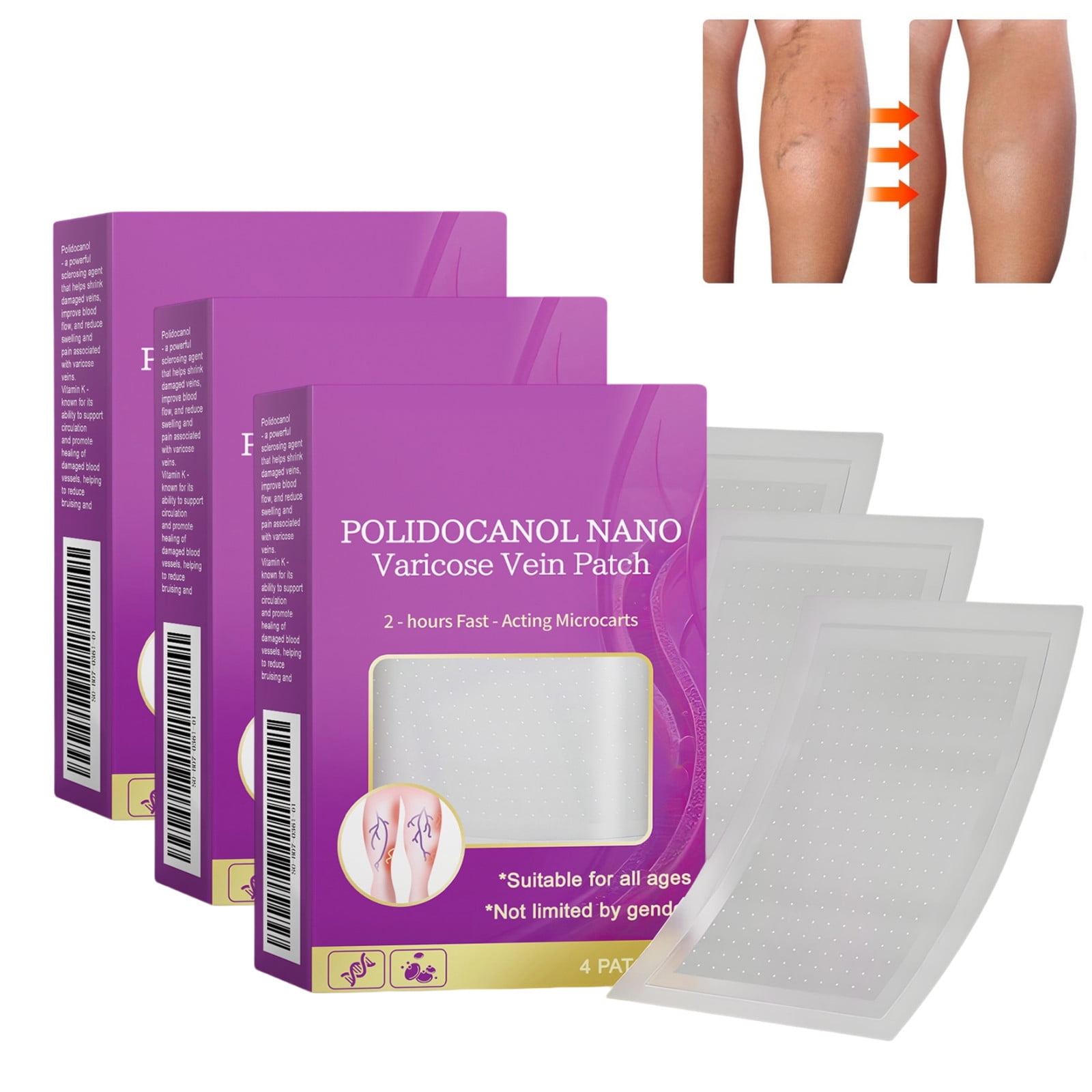 BCGPSHOP Nano Varicose Veins Plaster,Eliminate Varicose Veins,Naturally ...