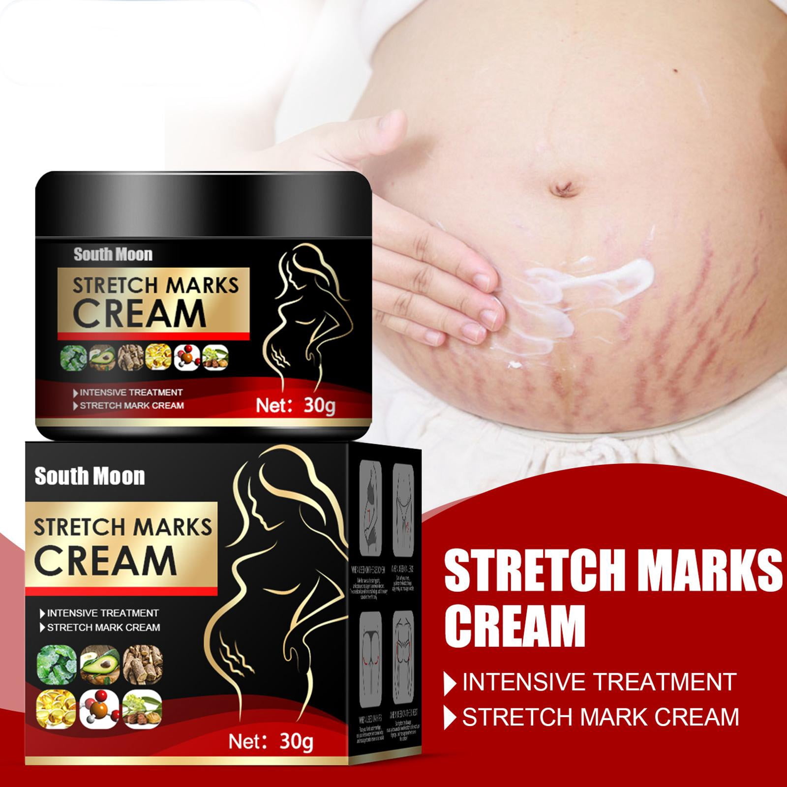 BE Stretch Mark Repair Essential Oil Scar Stretch Mark Removal Cream ...