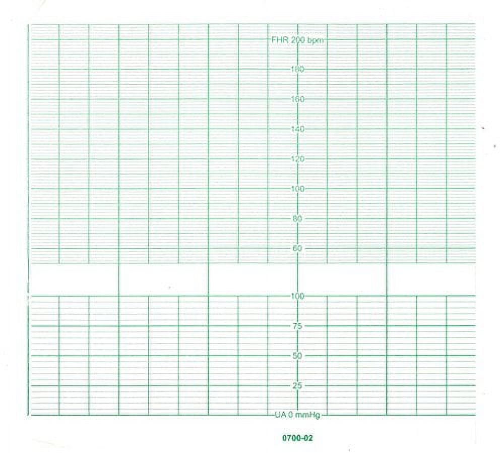 BIONET CARDIOCARE ECG Paper 152MM X 25M (5) - Walmart.com