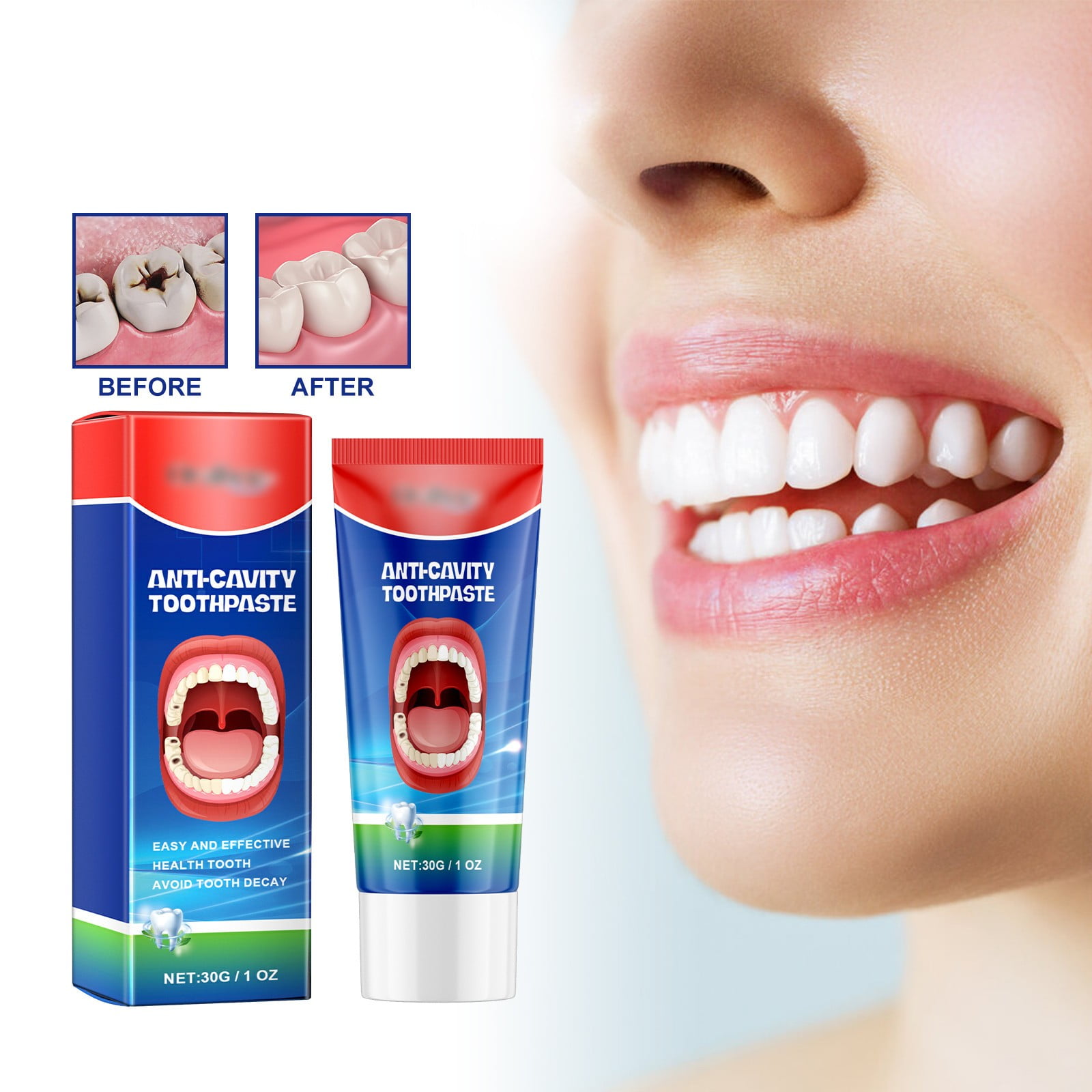 BNIXIREN Anti Toothpaste For Oral Cleaning Yellowing Teeth Protecting ...