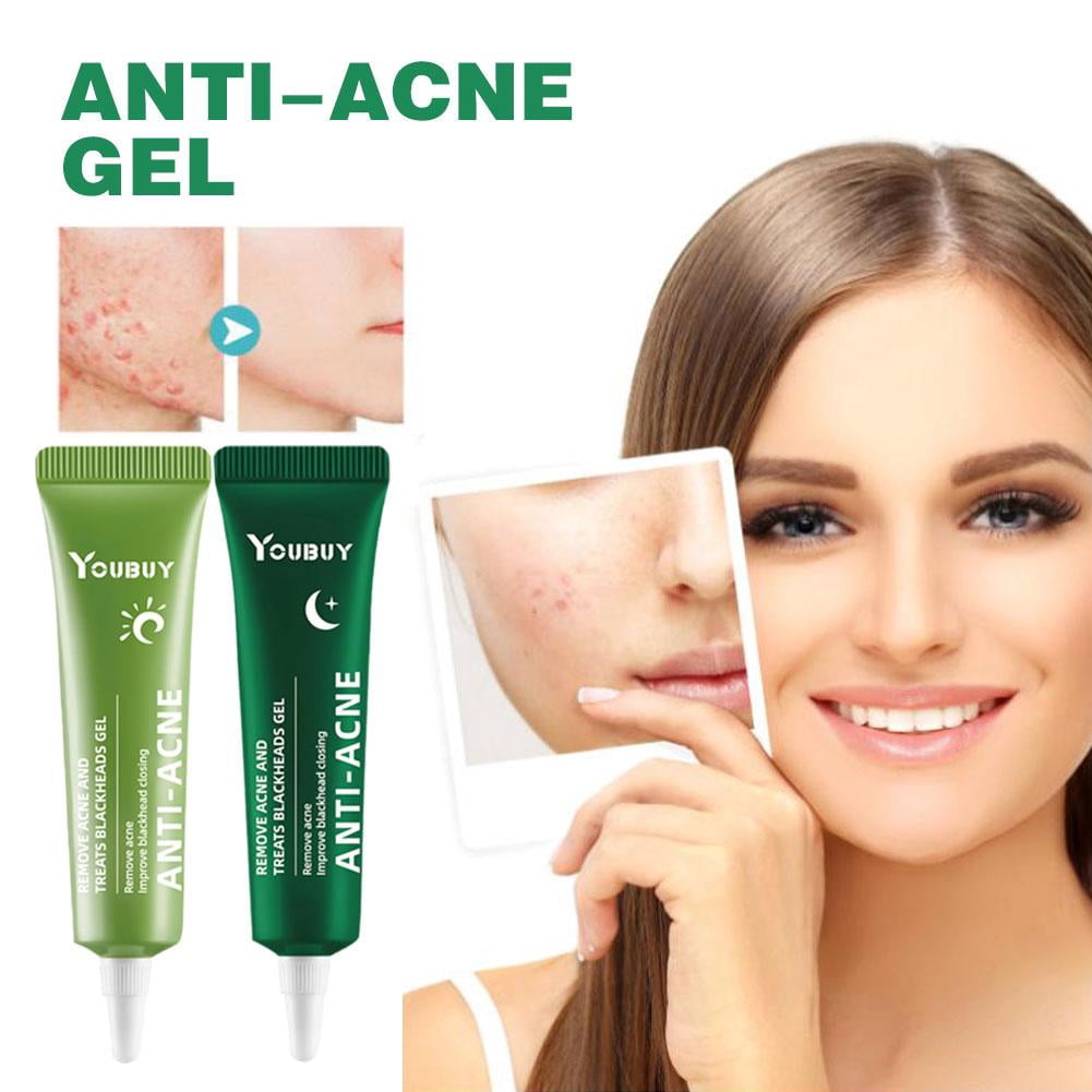 BQLQBQLQ Youbuy Antiacne Gel Diminish Acne Scars Gently Soothe Repair ...