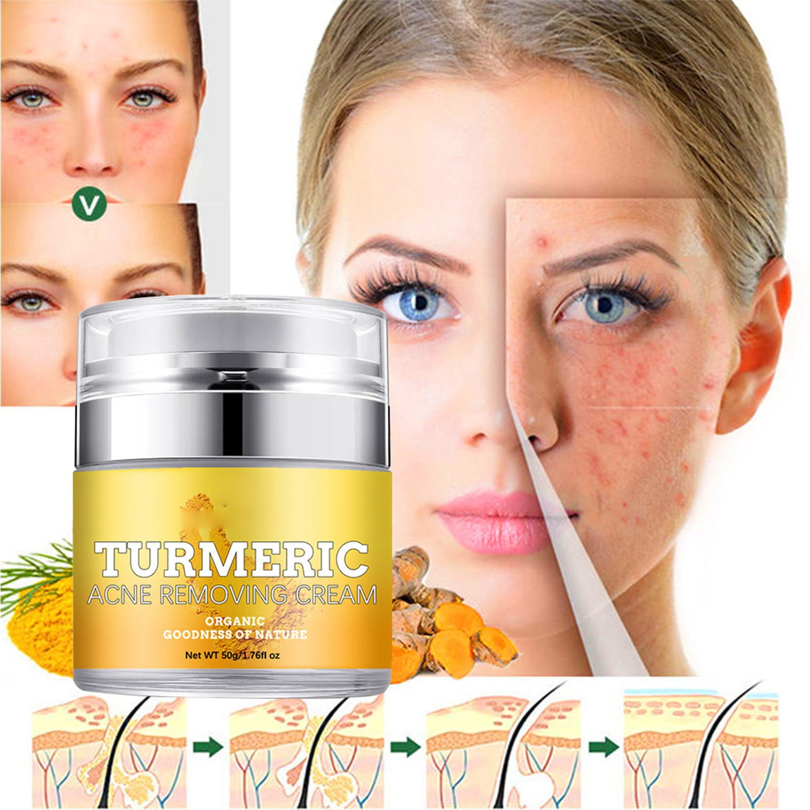 BRISEZZS Colección De Belleza! Clearance! Turmerics Acne Removing Face ...