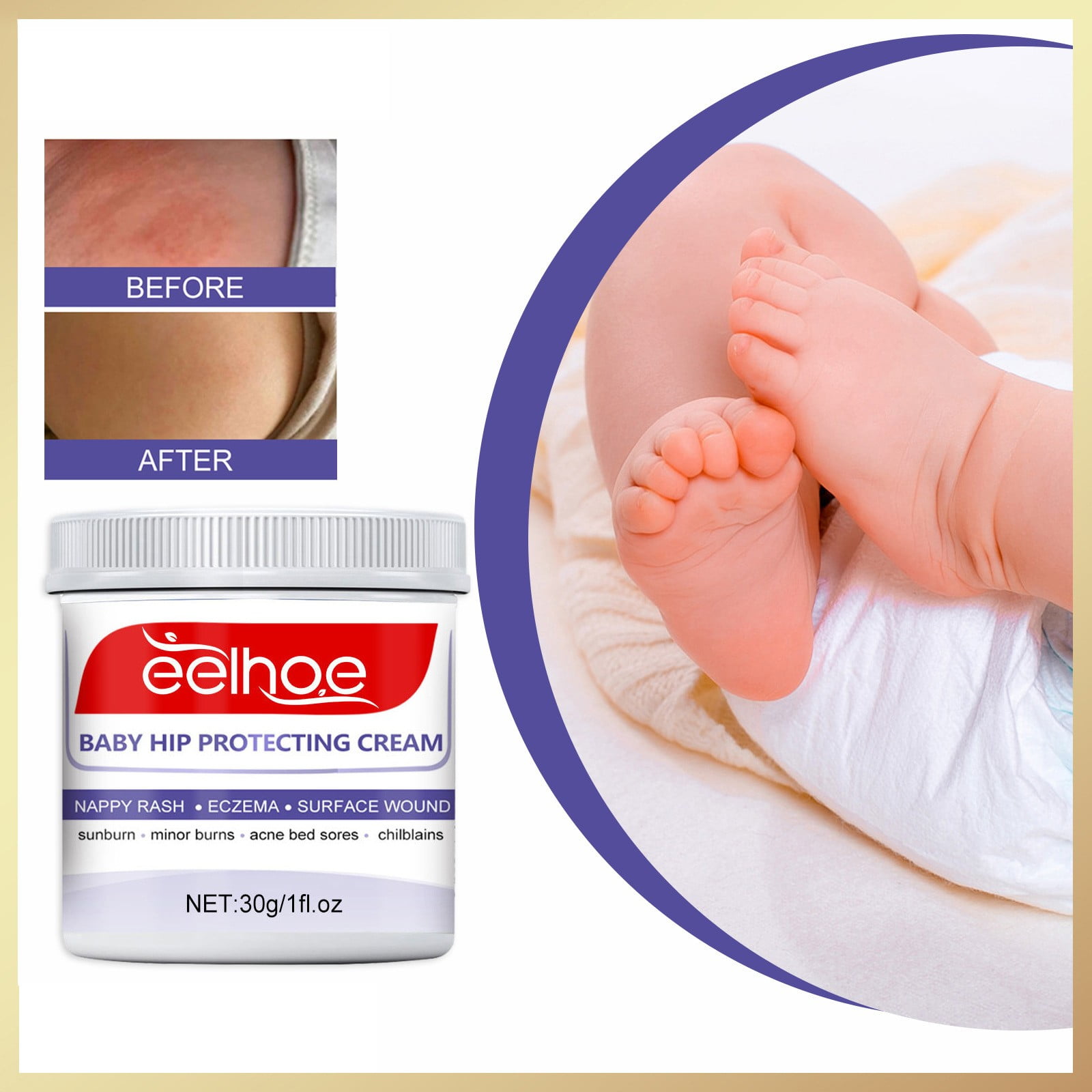 BRISEZZS Discount Baby Hip , Reduce Redness and Itching, Gentle Care ...