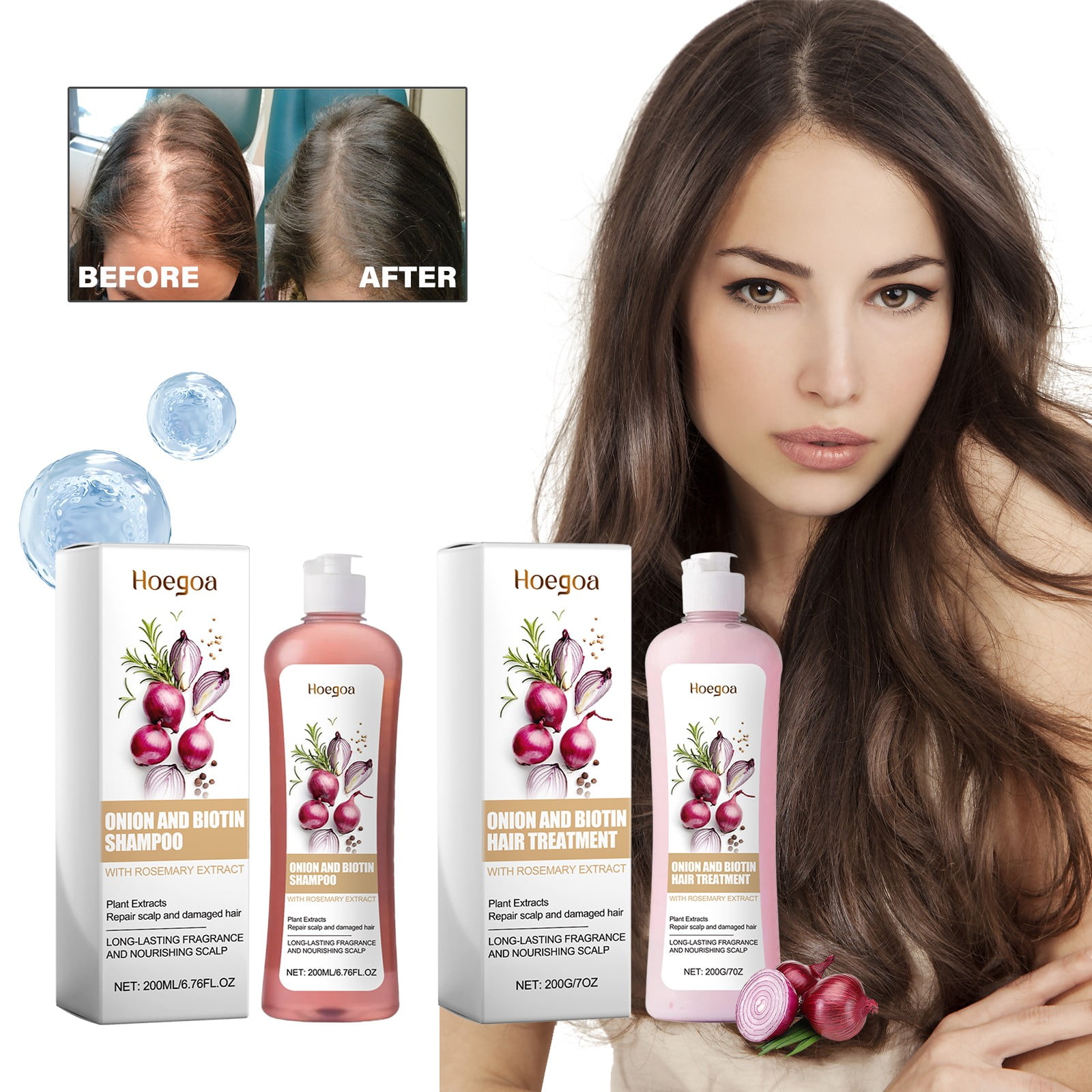 BRISEZZS Markdown O Nion, Biotin and R Osemary Shampoo, All Hair Types Conditioner Hair Care ...