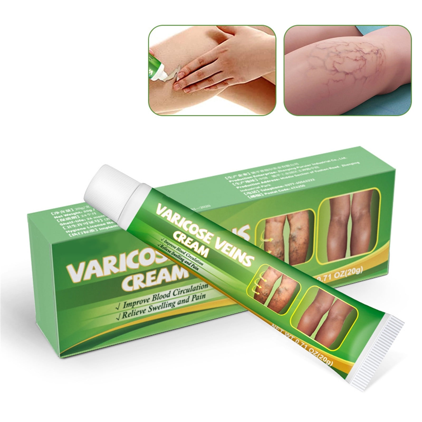 BRISEZZS Tratamiento De Las Venas Varicosas! Venoheal Varicose Vein ...