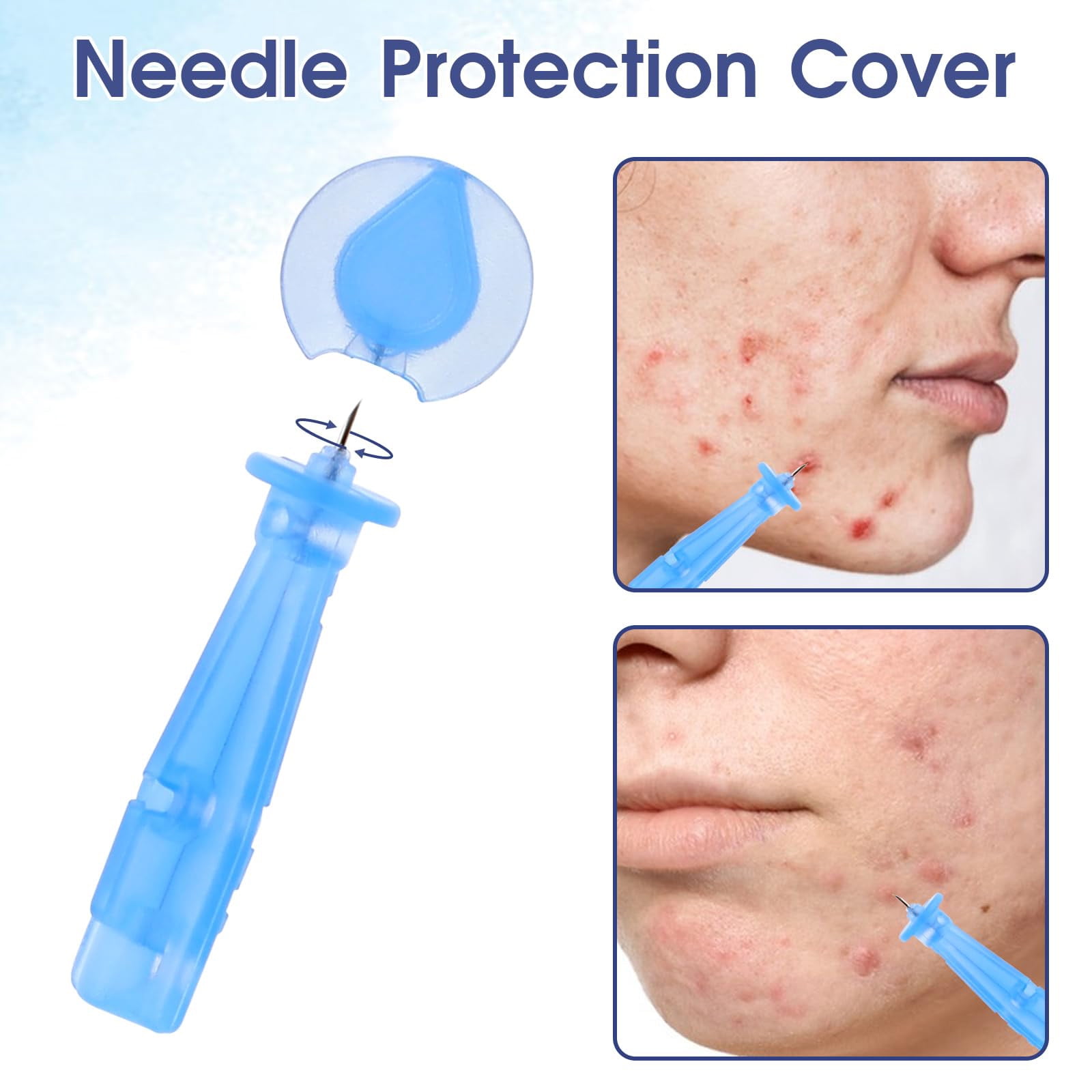 BYB Beauty Salon Disposable Pimple Extractor Closed Comedo Tool For ...