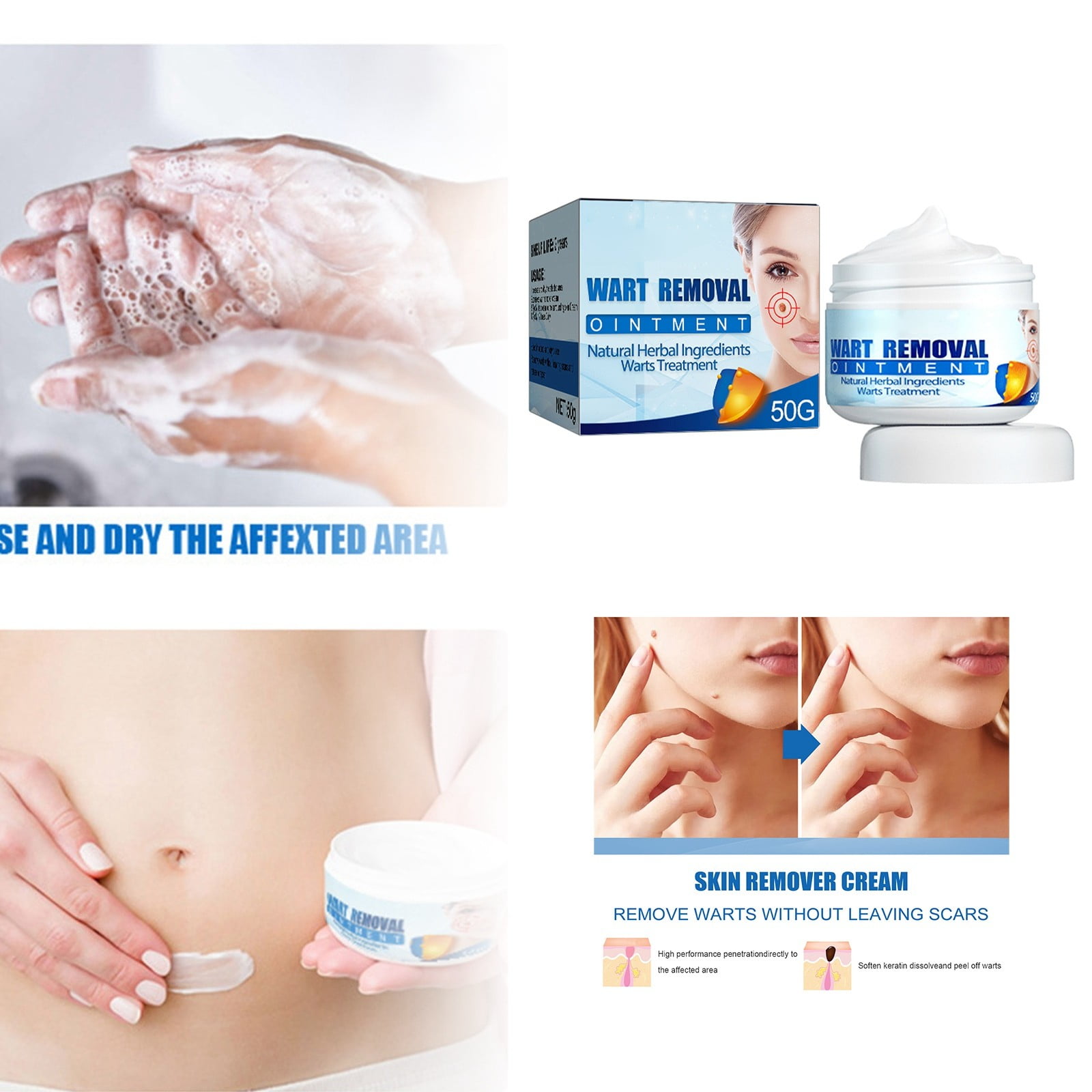 BYB Wart Removal Skin Cleansing Wart Body Care Flat Wart & Plantar Wart Remover Gentle Formula ...