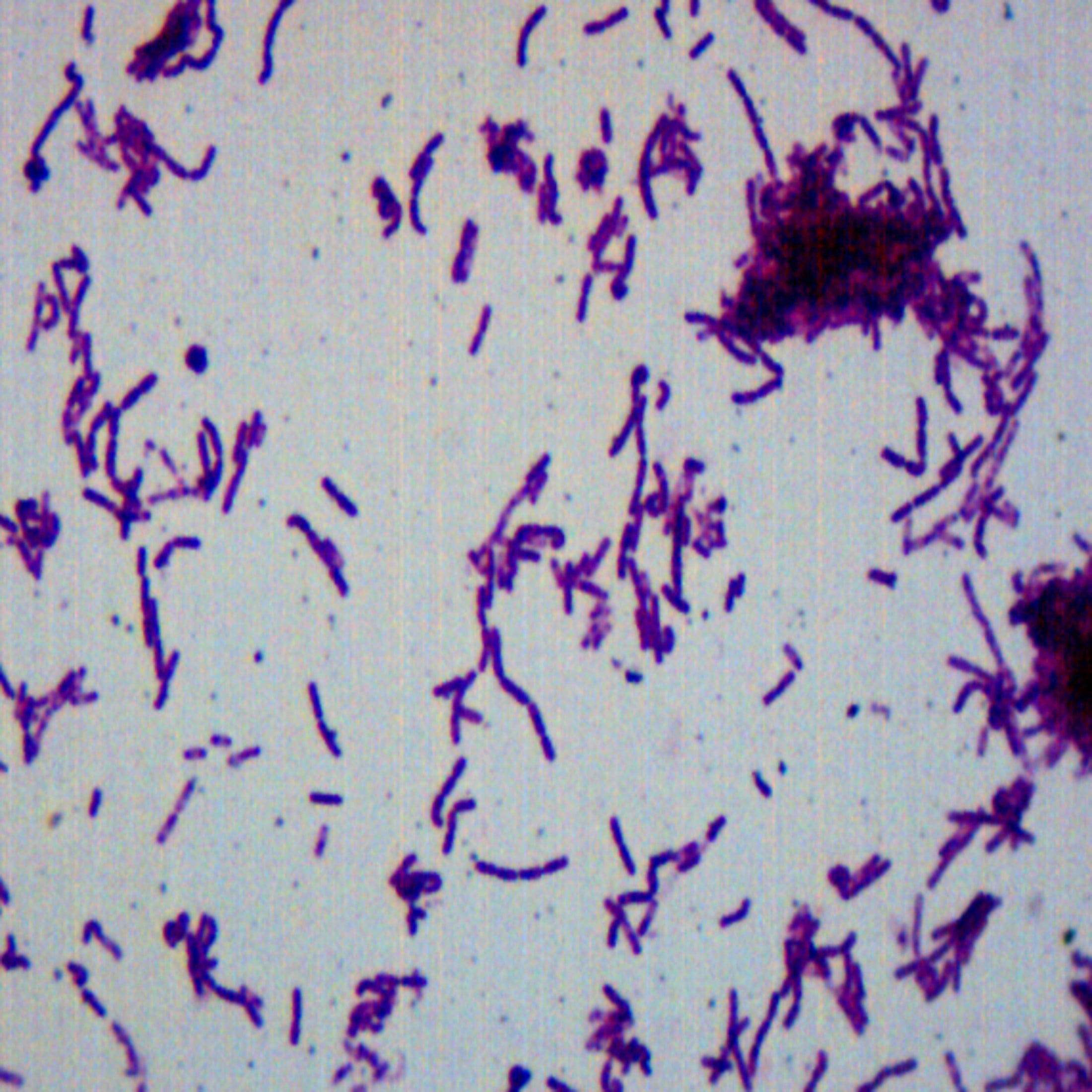 Bacillus Smear, Gram Negative Stain - Prepared Microscope Slide - 75 x ...