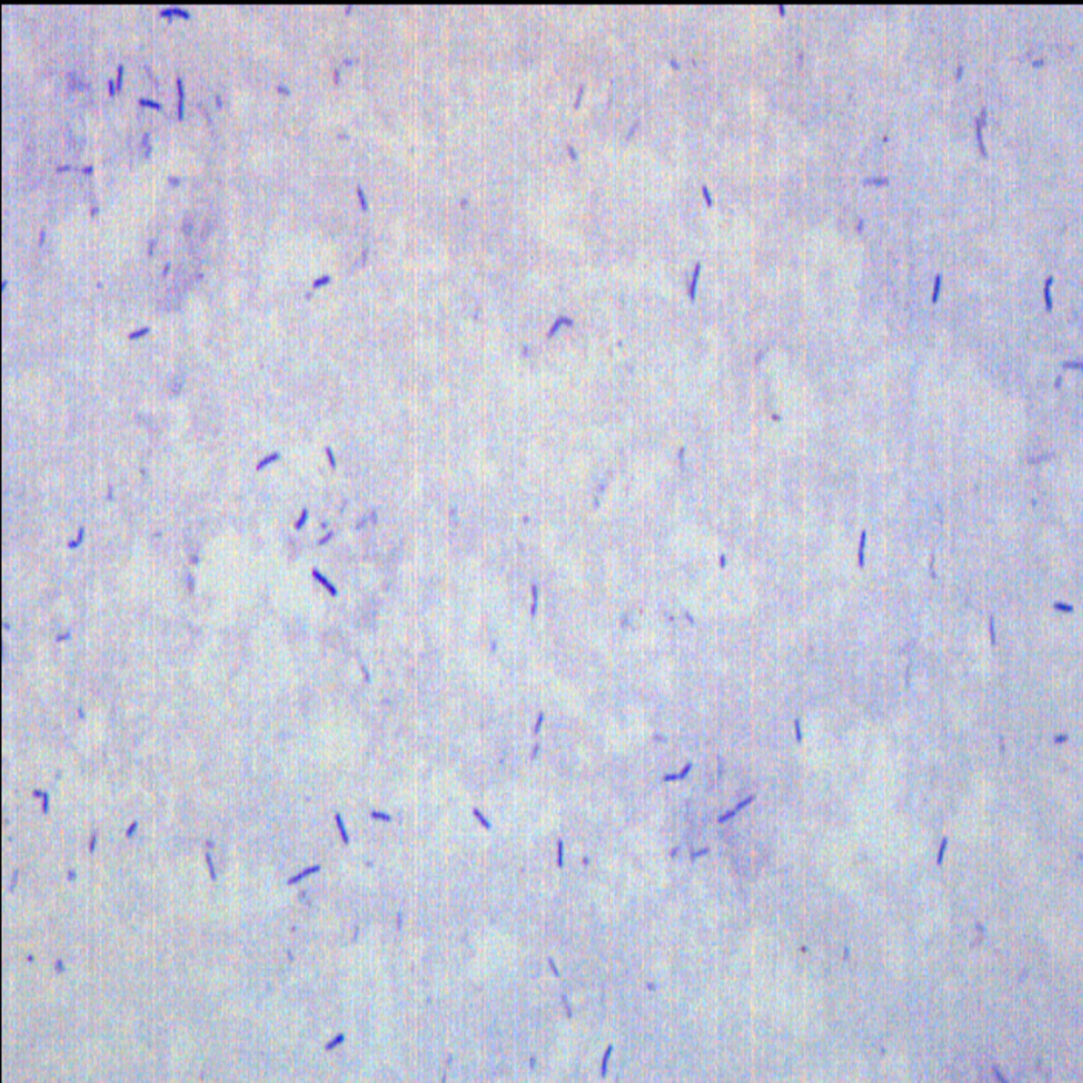 Bacillus Smear, Gram Positive Stain - Prepared Microscope Slide - 75 x ...