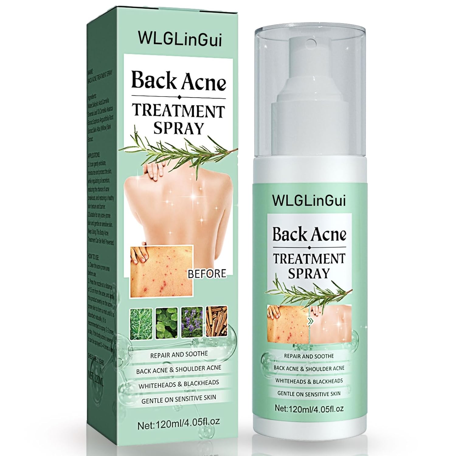 Back Acne Body Spray,Gentle Oil Control Body Acne Spray for Face,Back ...