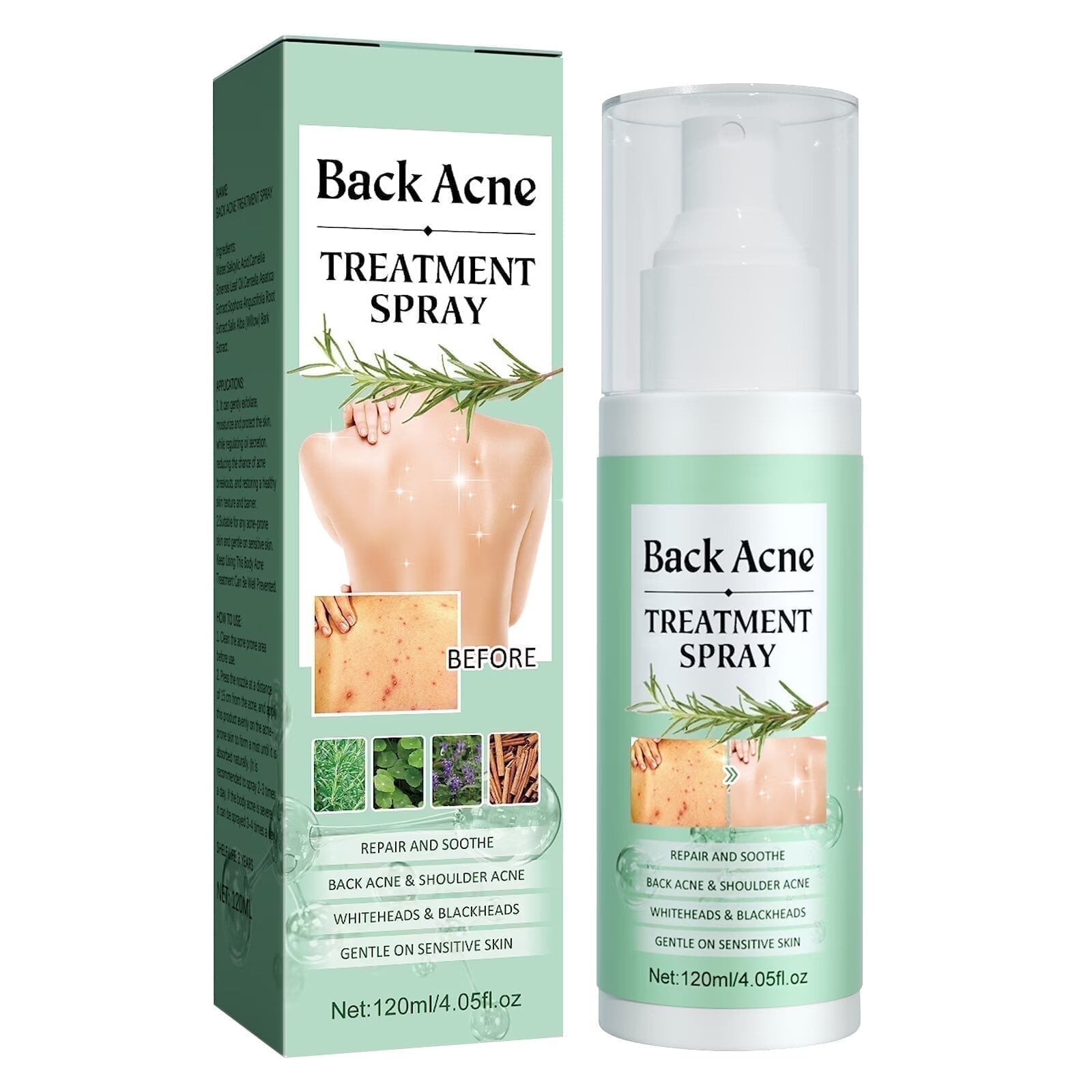 Back Acne Treatment,Back Acne Treatment Spray,Clear and Comfortable ...