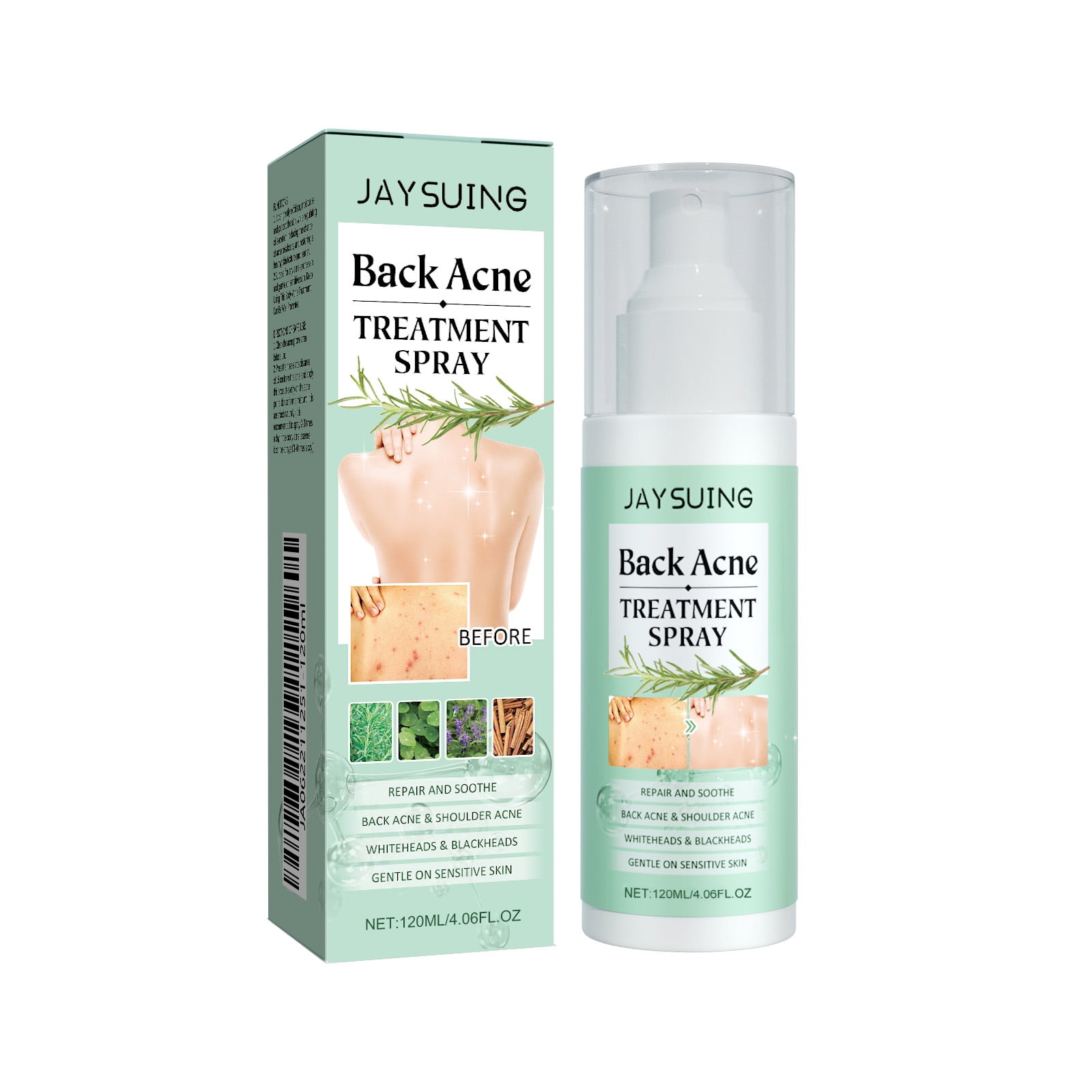 Back Care Spray 120ml｜Soothe Back Skin｜Moisturize & Clean｜Post-Exercise ...