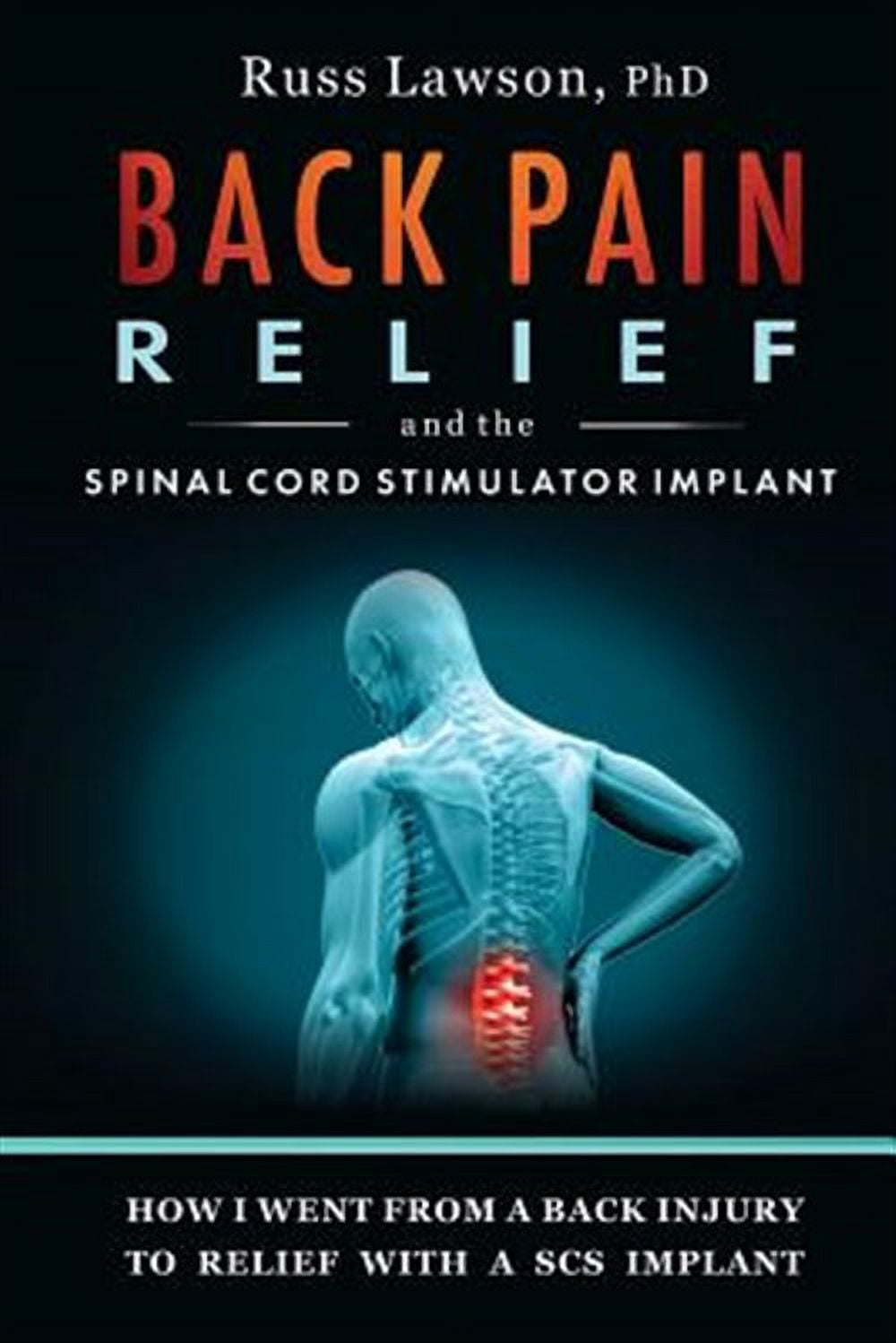 Back Pain Relief and the Spinal Cord Stimulator Implant: How I Went ...