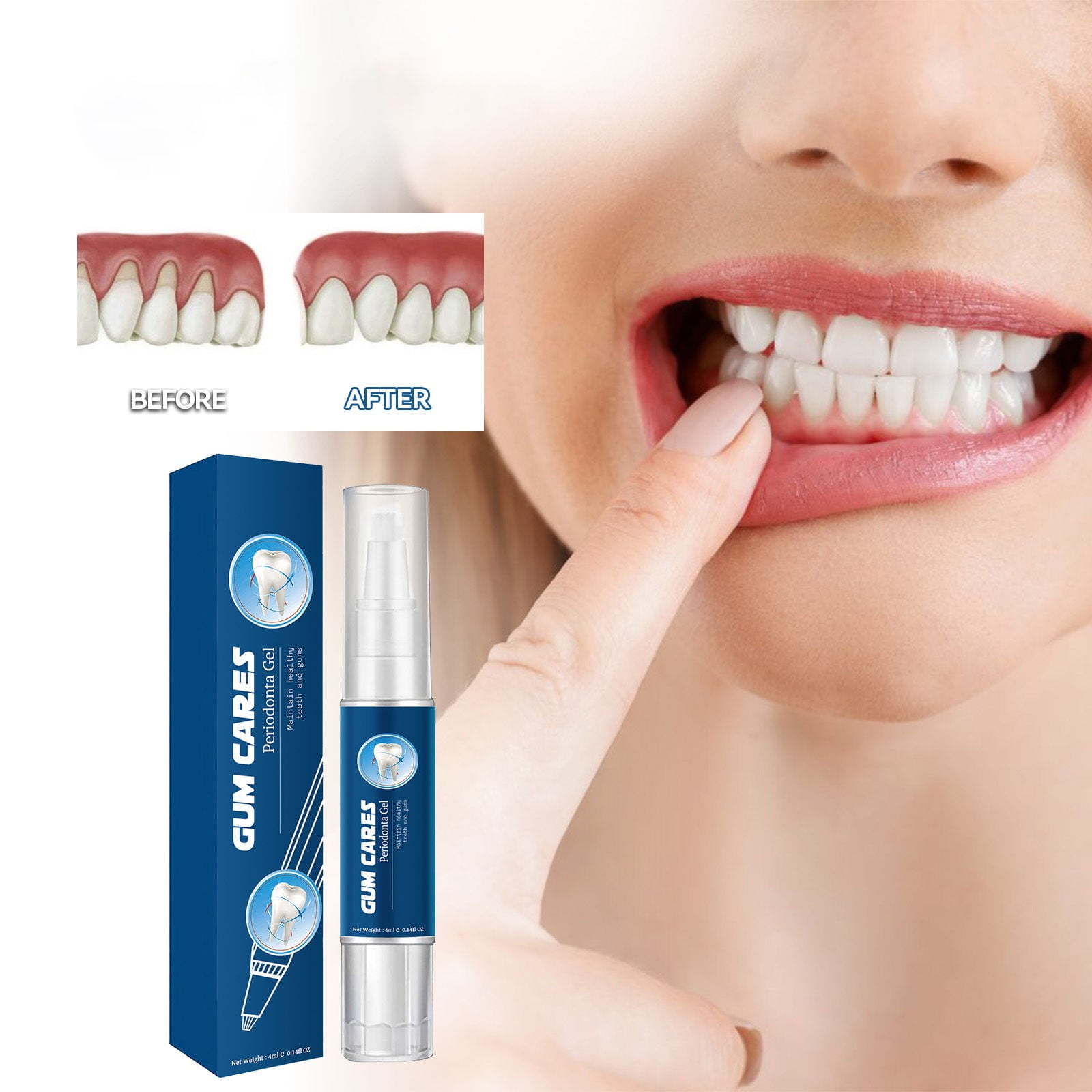 Back to School Clearance Tooth care,Gingival Care Gel Deep Cleaning ...