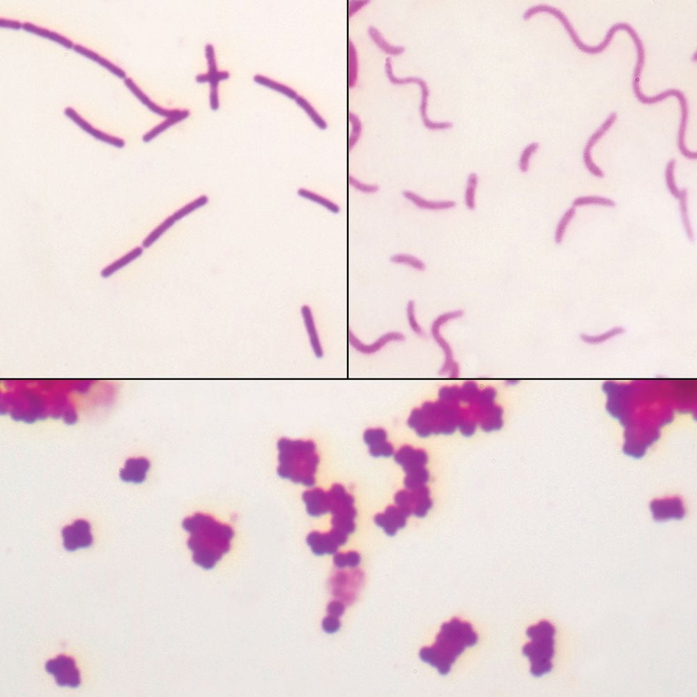 Spirilla Bacteria 100x