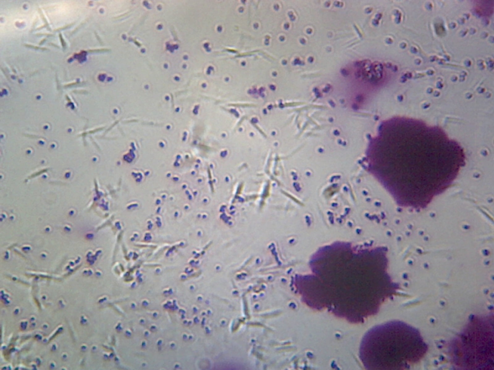 Bacteria from Human Mouth, Showing Different Types; Smear by Go Science ...