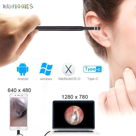 Otoscopes in Patient Care - Walmart.com