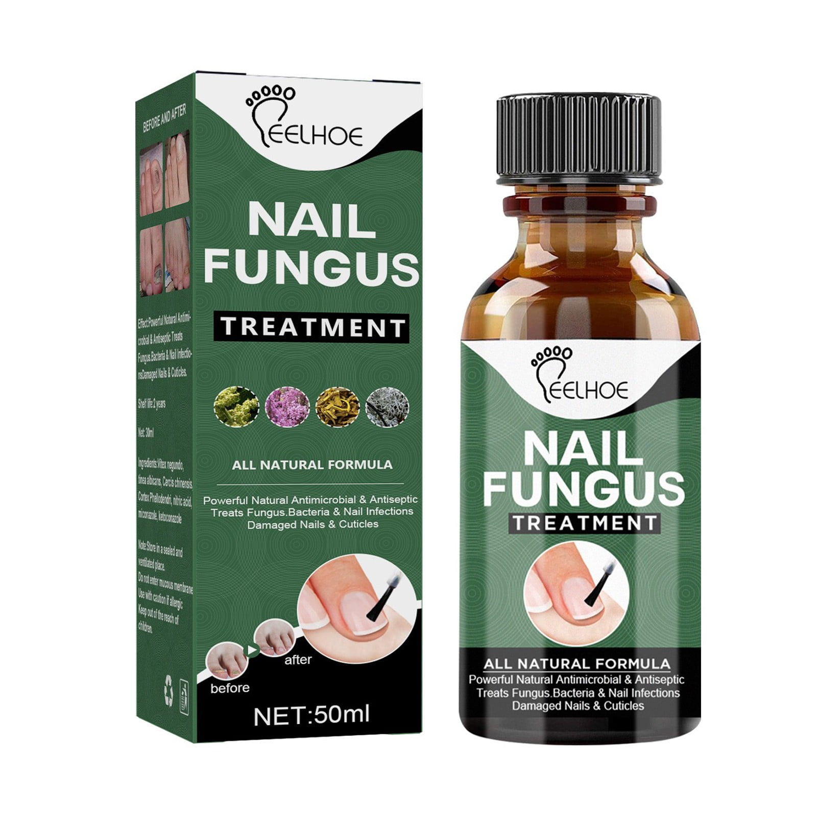 Bagmrteho Extra Strength Nail Liquid Toenail Nail Solution Toenails And ...