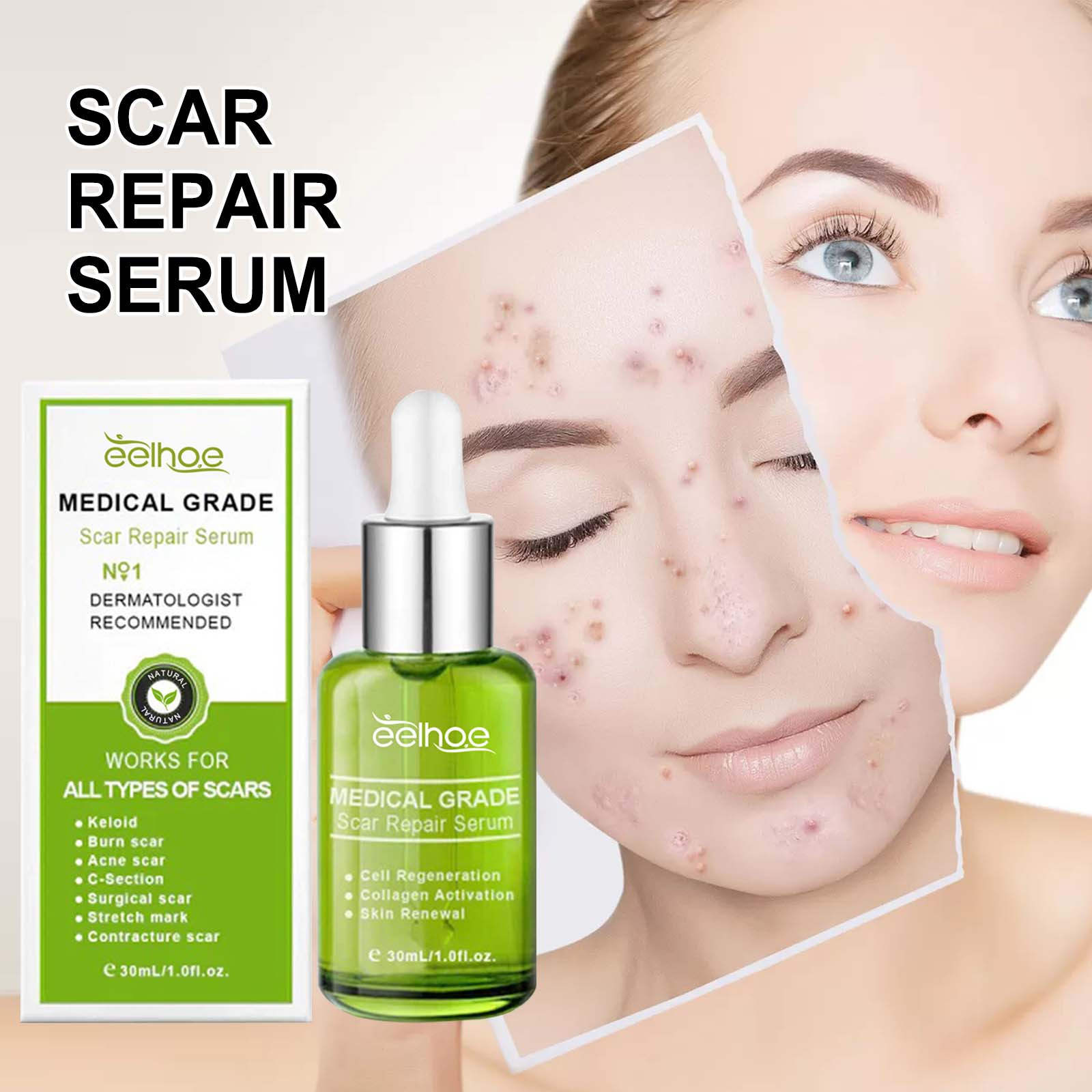 Banghong Scar Repair Essence Fade Scar Pregnancy Scar Repair Essence ...