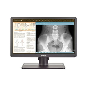 24" Computer Monitors