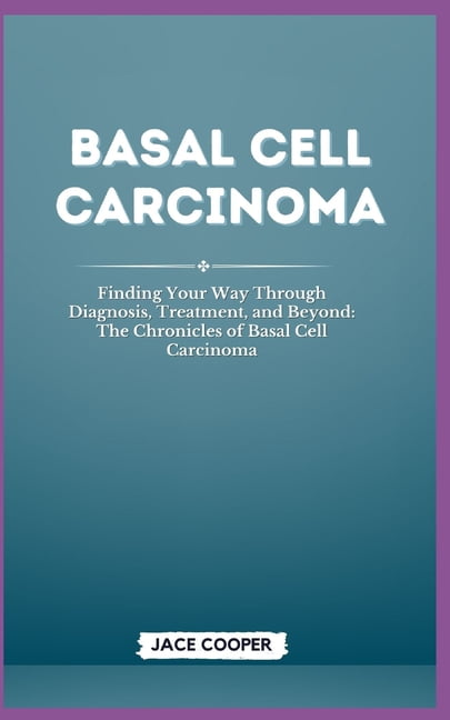 Basal Cell Carcinoma: Finding Your Way Through Diagnosis, Treatment ...