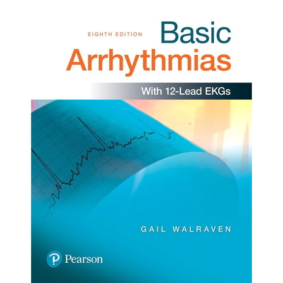Basic Arrhythmias, (Paperback) - Walmart.com