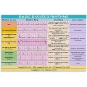 Ekg Poster