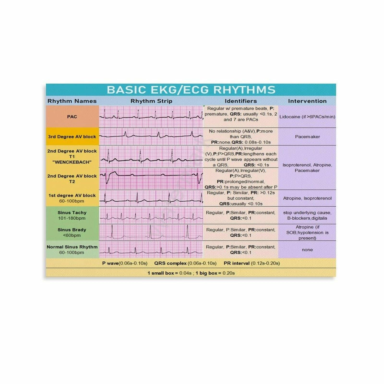 Basic ECG Rhythms Poster, EKG Heart Rhythms Poster, EKG Knowledge Poster Canvas Painting Wall ...