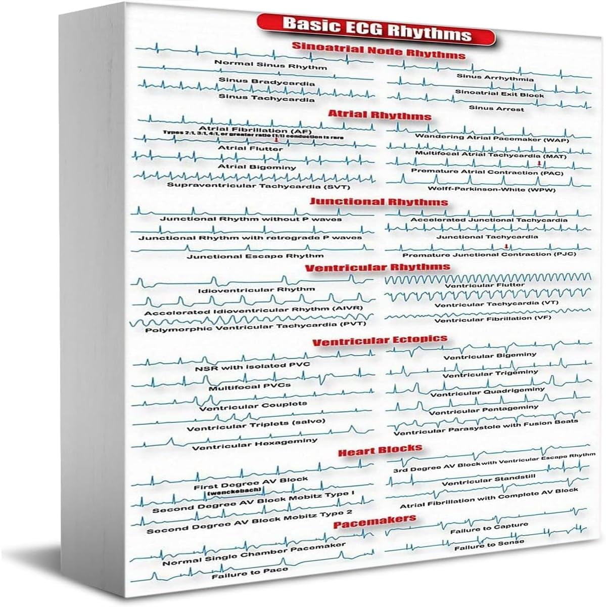 Basic Ecg Rhythms Infographic Cardiology Study Guide Wood Box Sign Desk ...