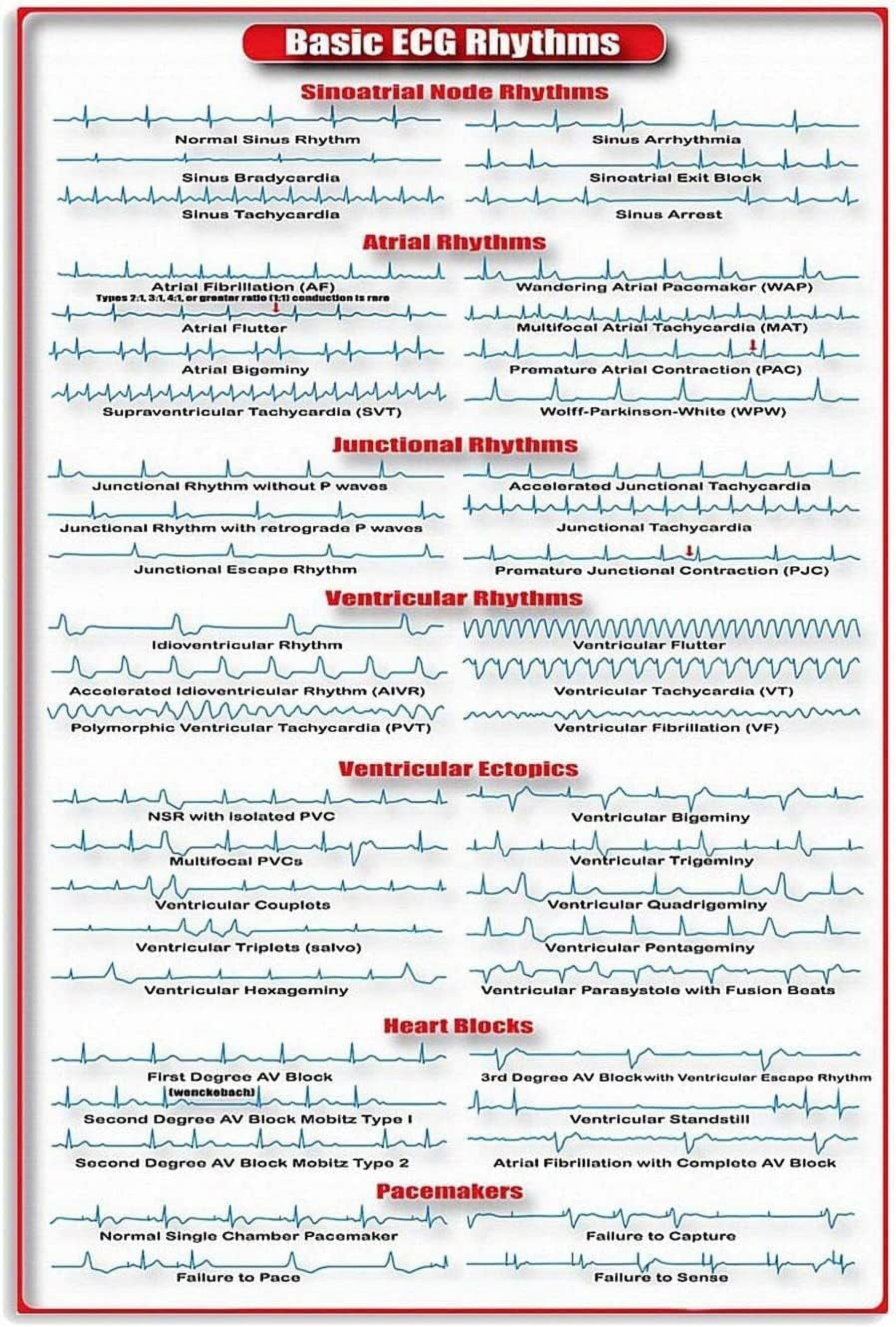 Basic Ecg Rhythms Infographic Metal Sign Wall Decor Cardiology Study ...