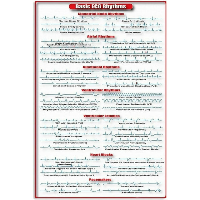 Basic Ecg Rhythms Infographic Metal Sign Wall Decor Cardiology Study ...