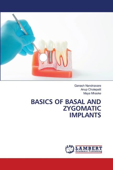 Basics of Basal and Zygomatic Implants, (Paperback) - Walmart.com