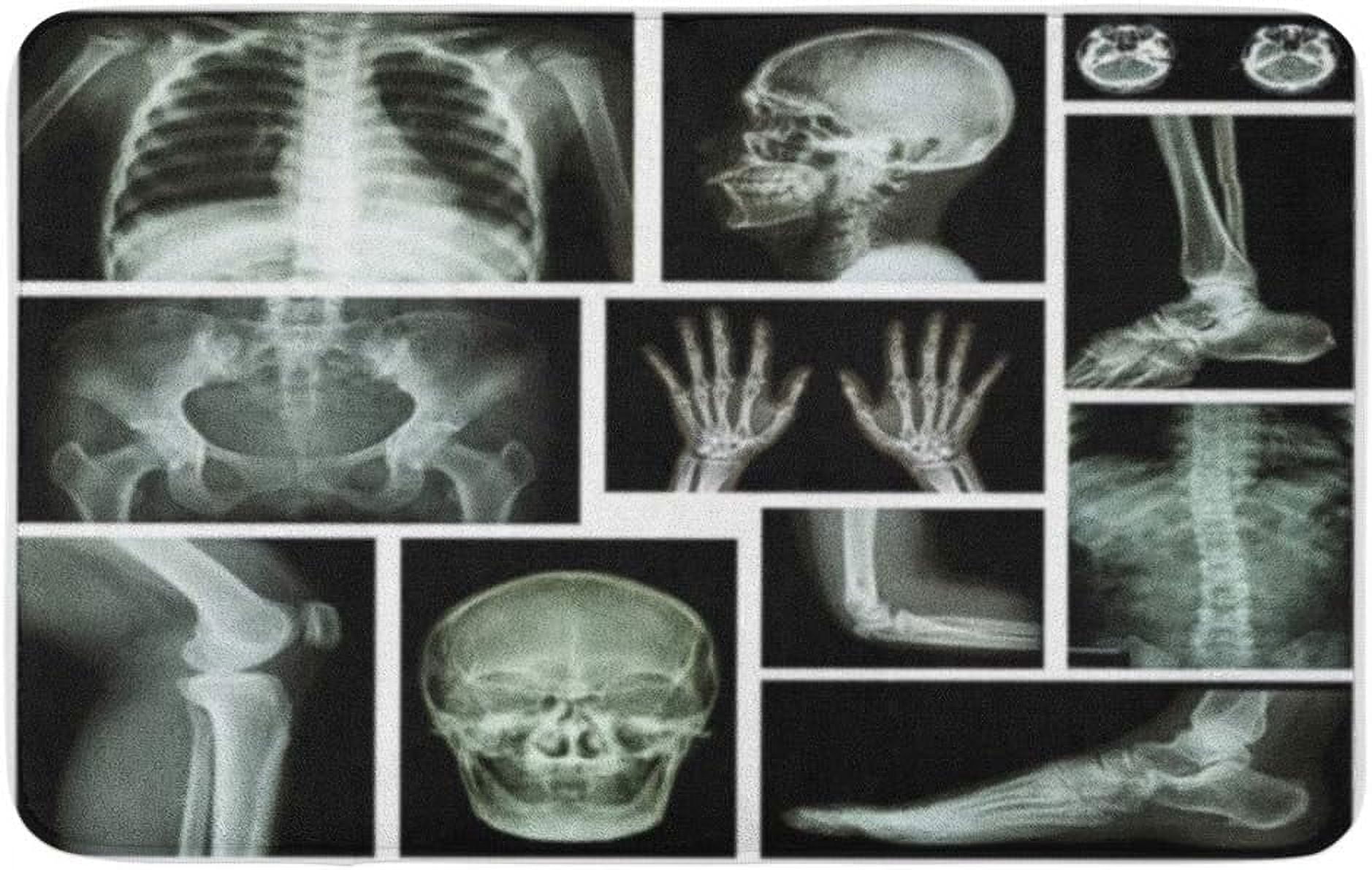 Bath Mat Anatomy of X Ray Multiple Part Human Skeletal System Cozy ...