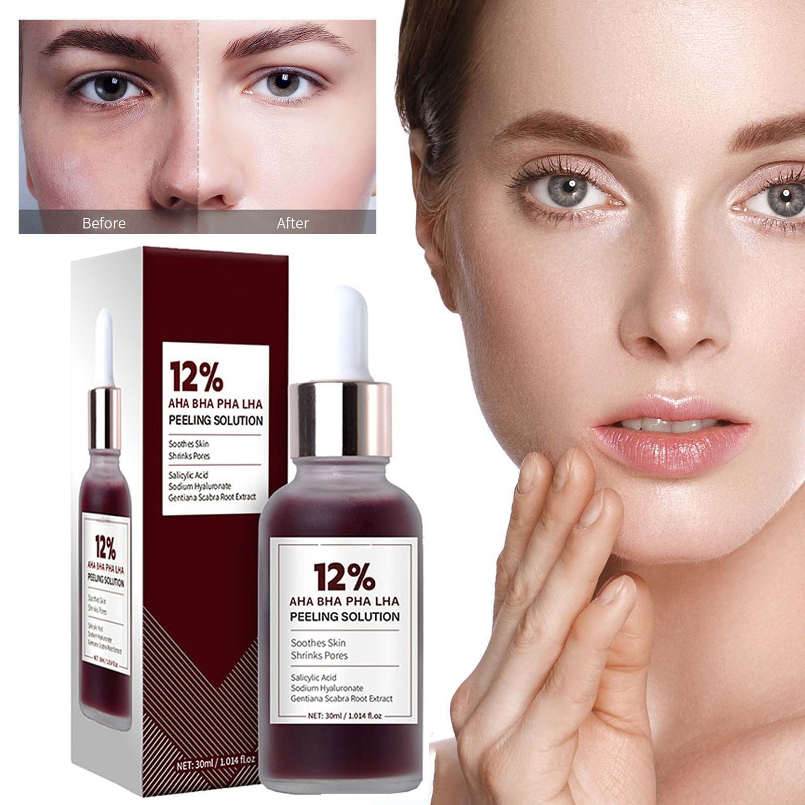 Baycosin SKINTIFIC Fruit Salicylic Lotion Nourishing Soothing Skin ...