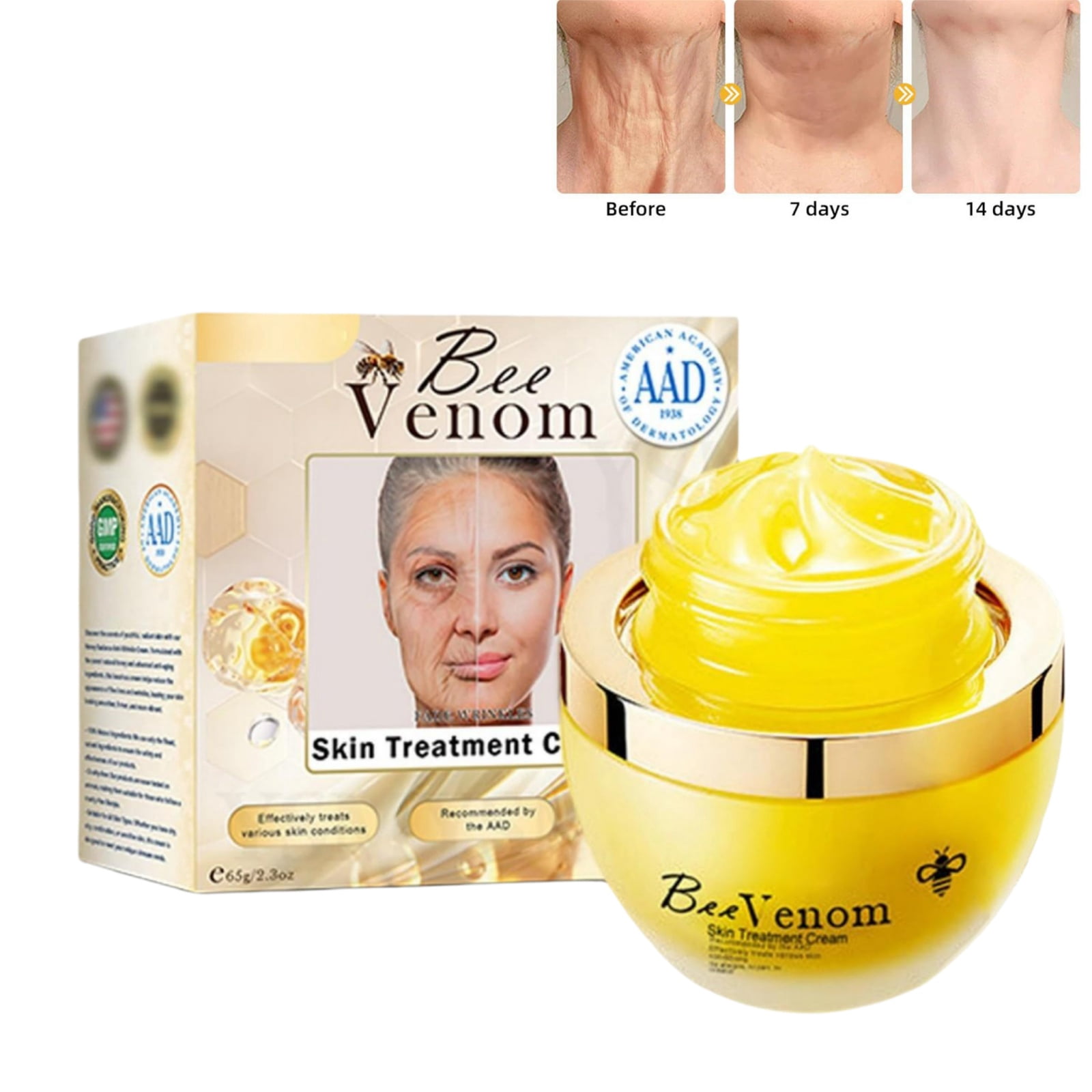 Be®e Ven®om Skin Cream, 2025 New Be®e Ven®om for skin,Be®e Ven®om ...