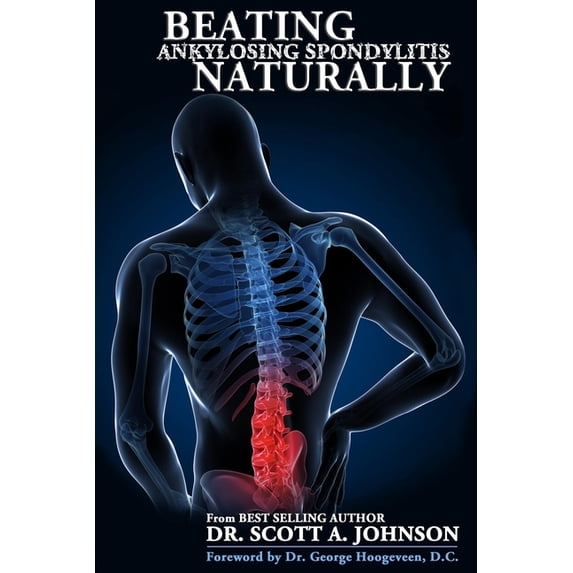 Beating Ankylosing Spondylitis Naturally (Paperback) - Walmart.com