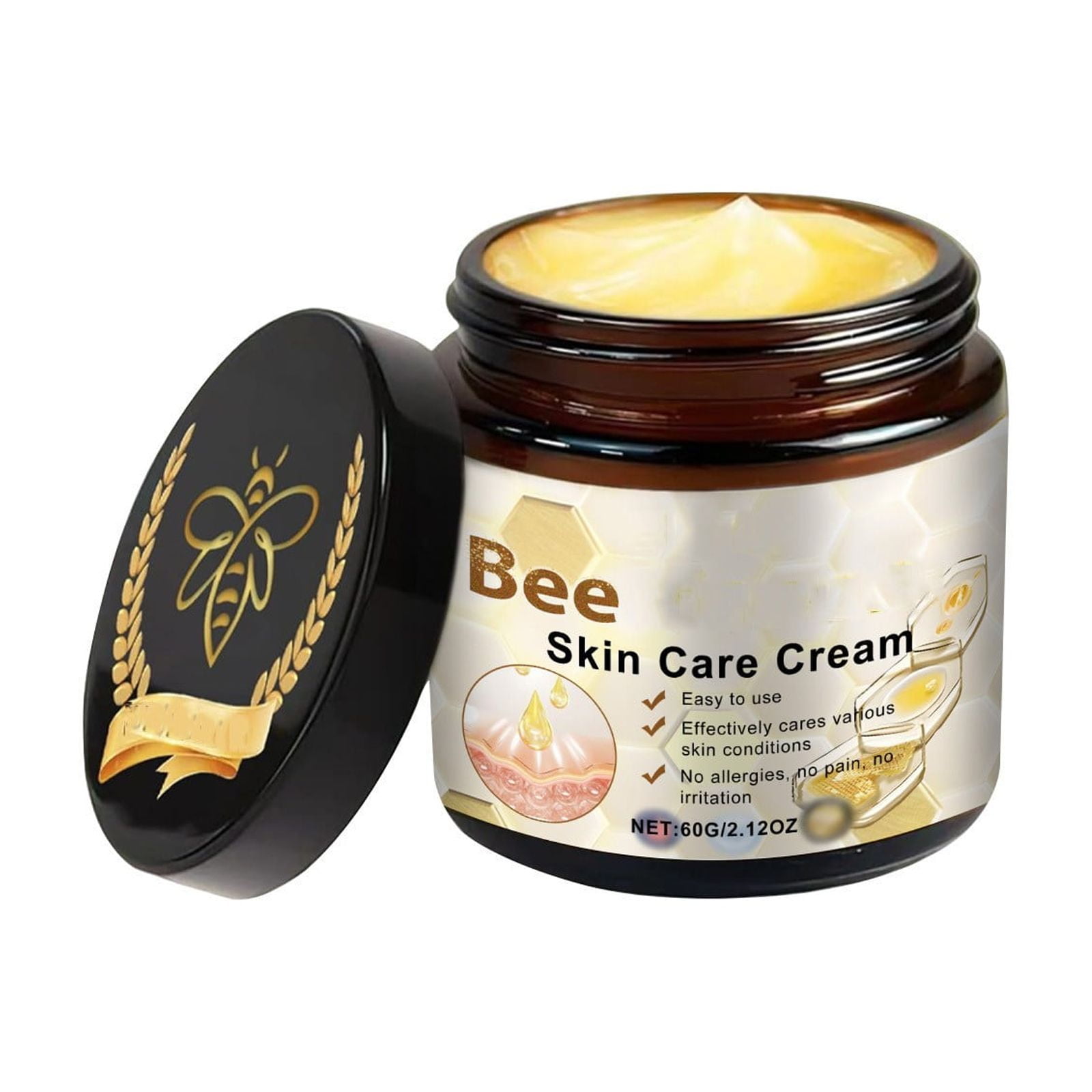 Bee Removal Nevus Skin Care Cream Herbal Gentle Whitening Nevus ...