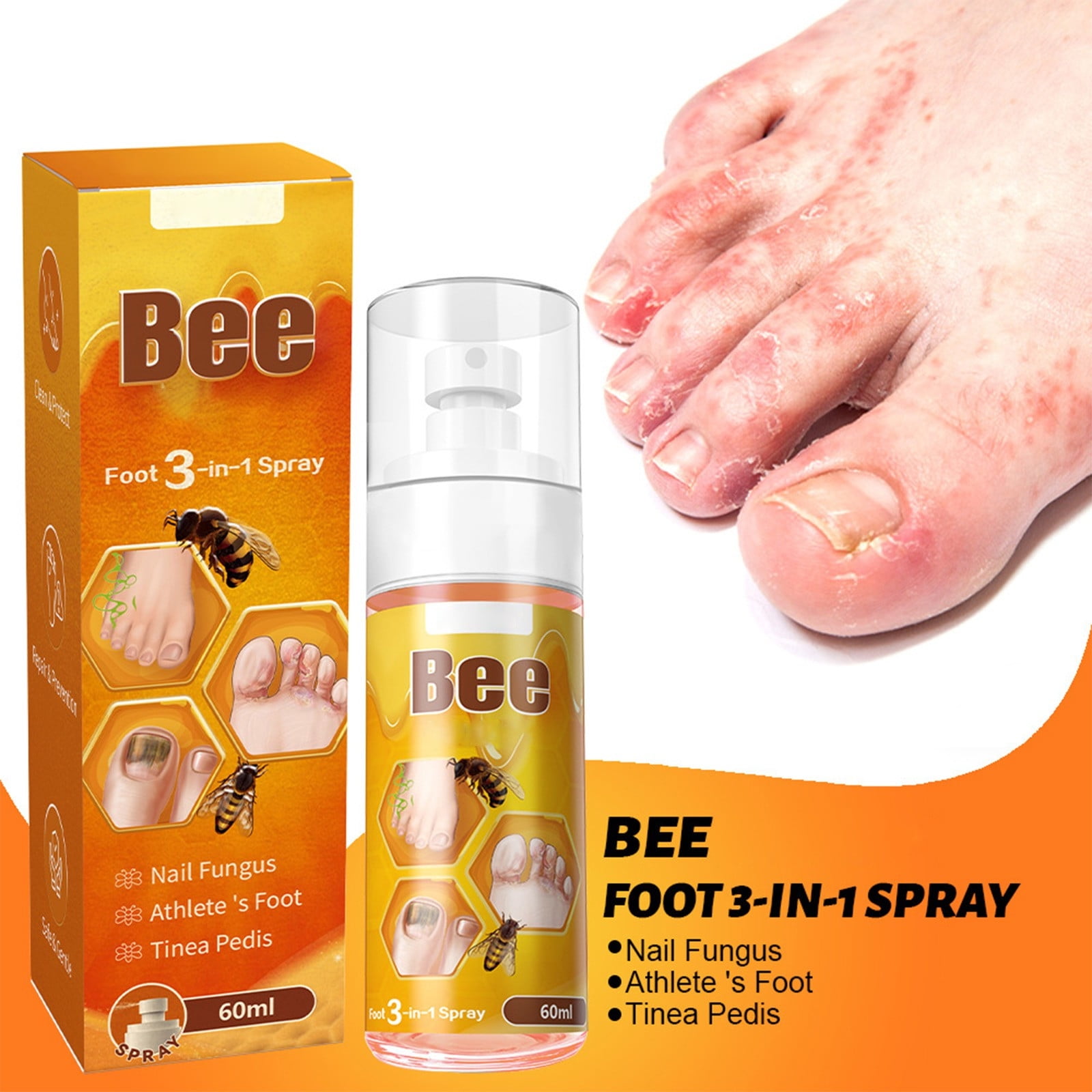 Bee Ve?nom Bee Nail Spray Growth Oil Nail Oil Mycosis Care For Nail Mycosis Foot Mycosis Red ...